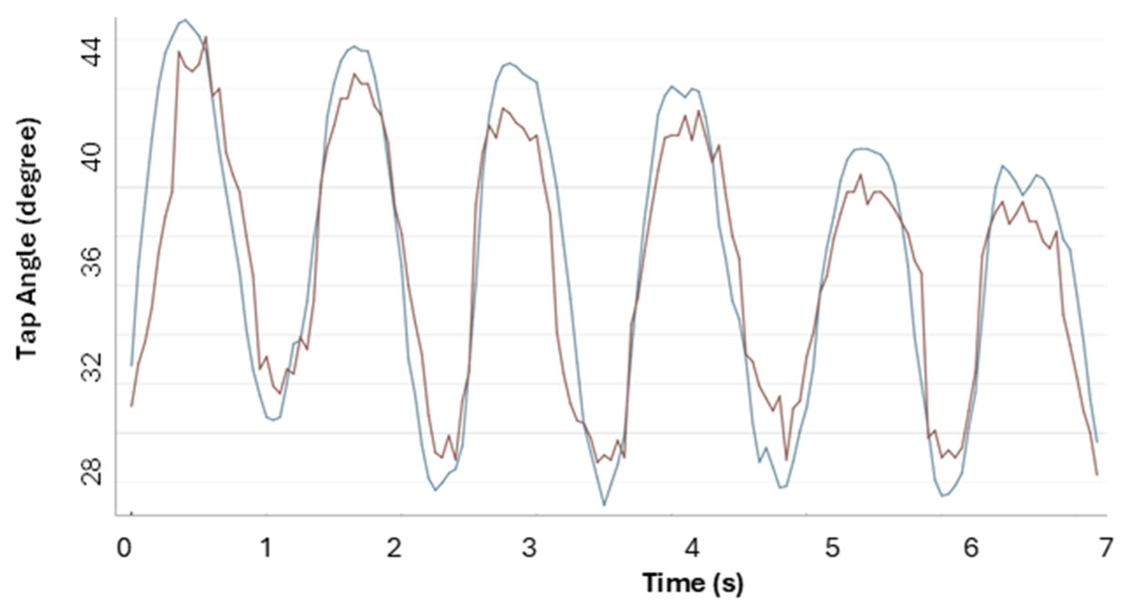A 2D Hand Pose Estimation System Accuracy for Finger Tapping Test ...