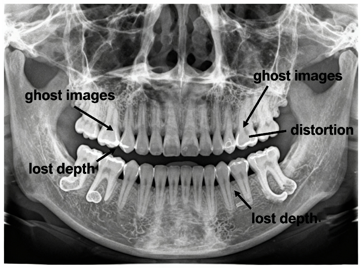 Interactive Holographic Reconstruction of Dental Structures: A Review ...