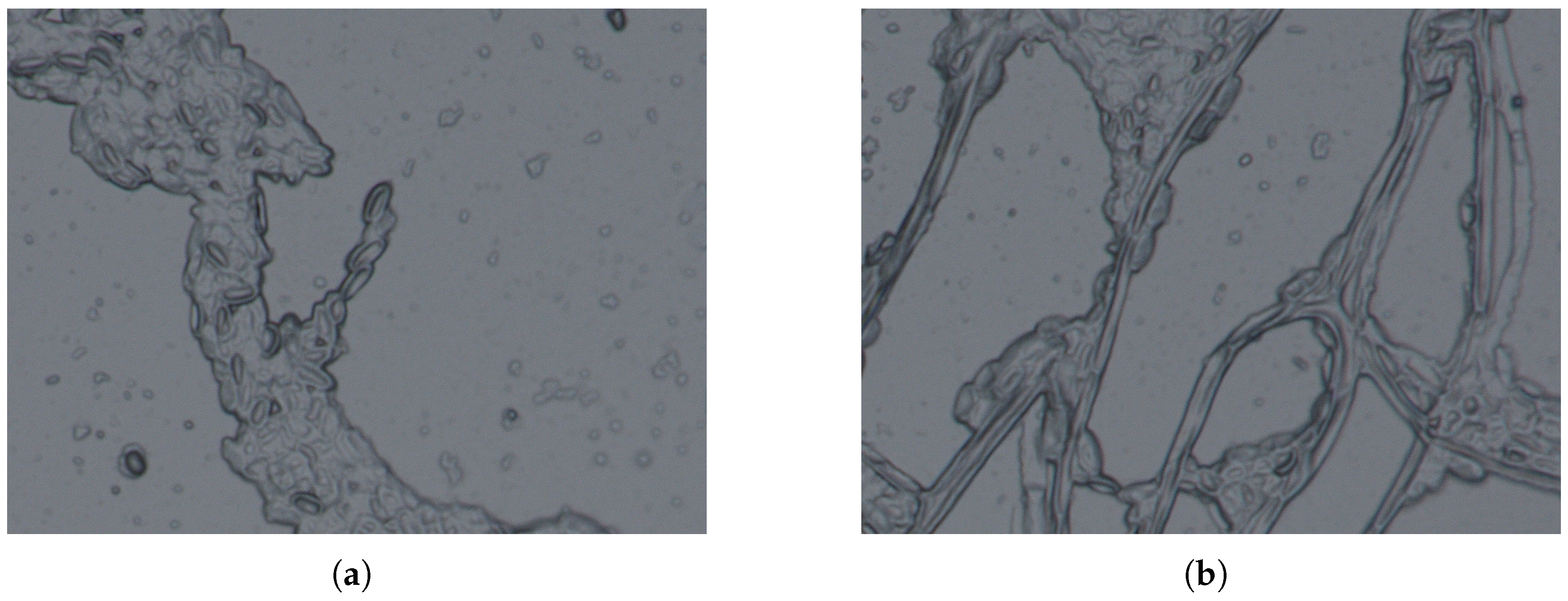 Machine Learning-Driven Soil Fungi Identification Using Automated ...