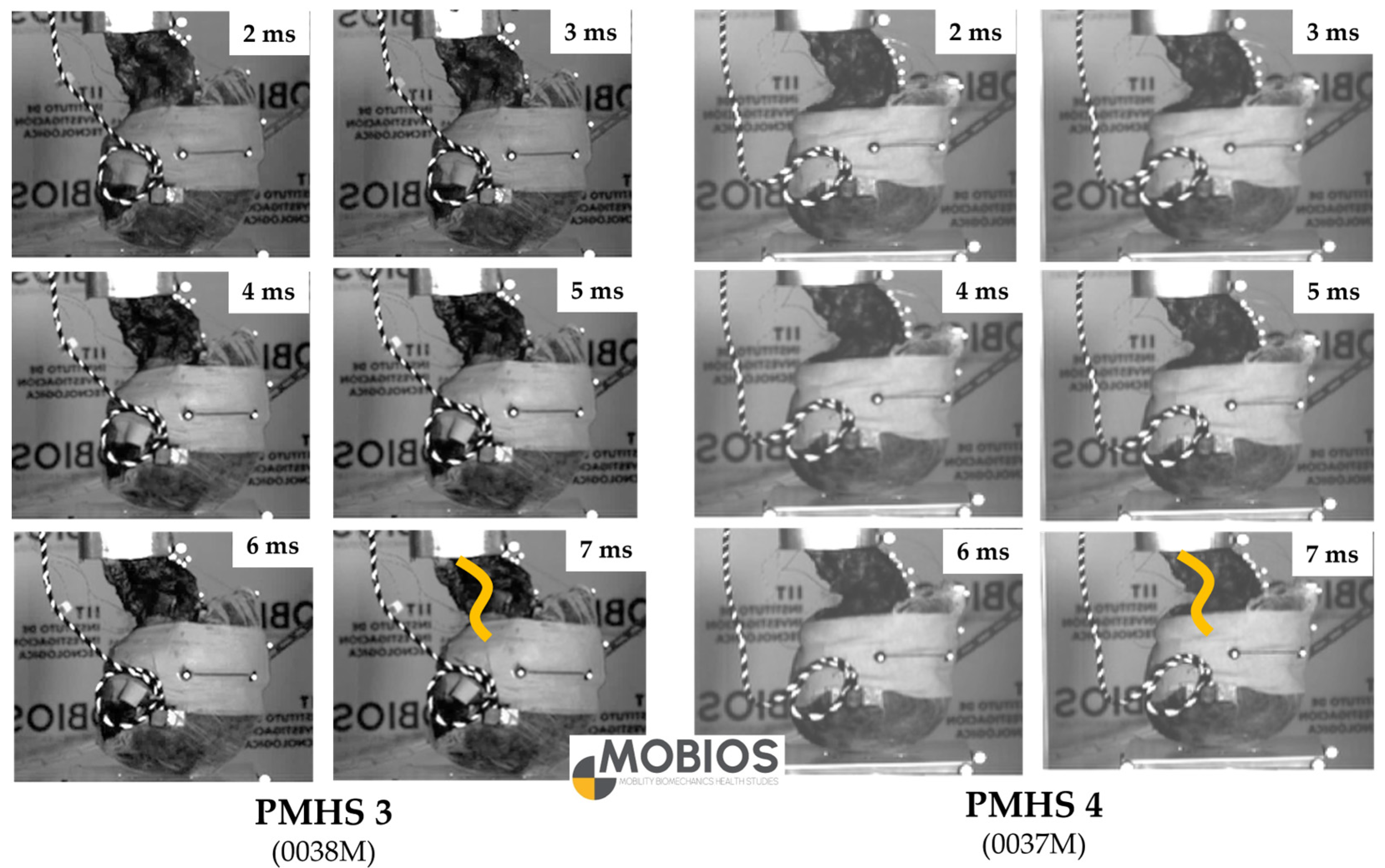 The Effect of Dynamic Injurious Axial Impact on Human Cervical ...