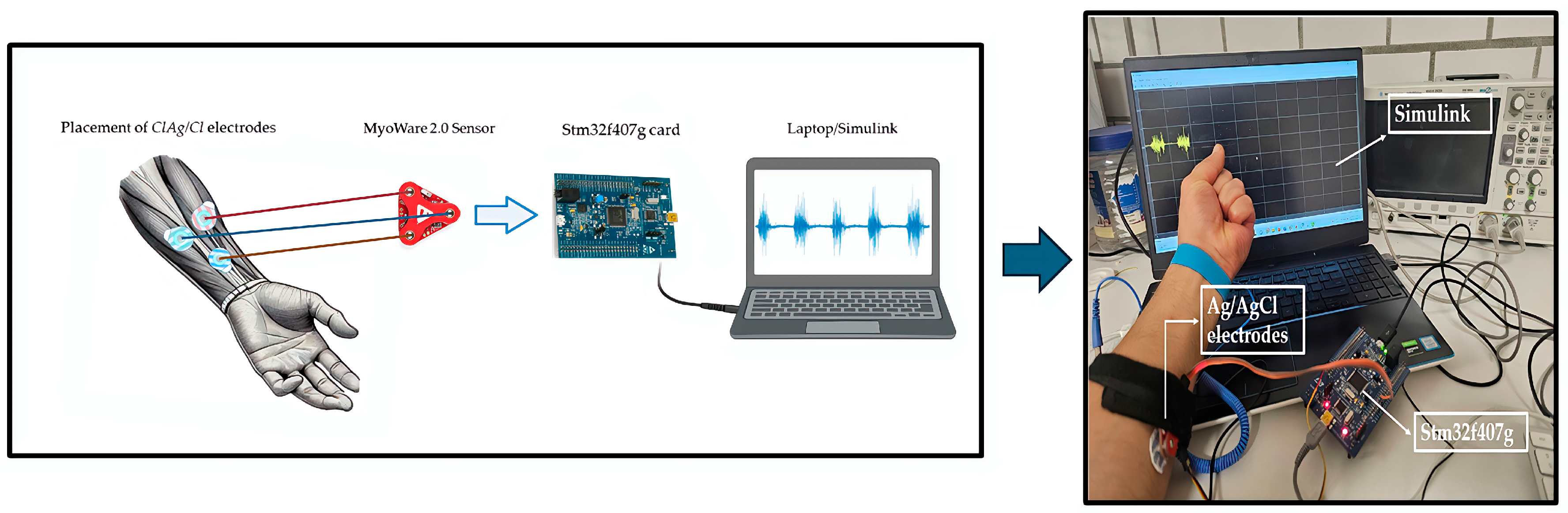 Comparative Evaluation of EMG Signal Classification Techniques Across ...