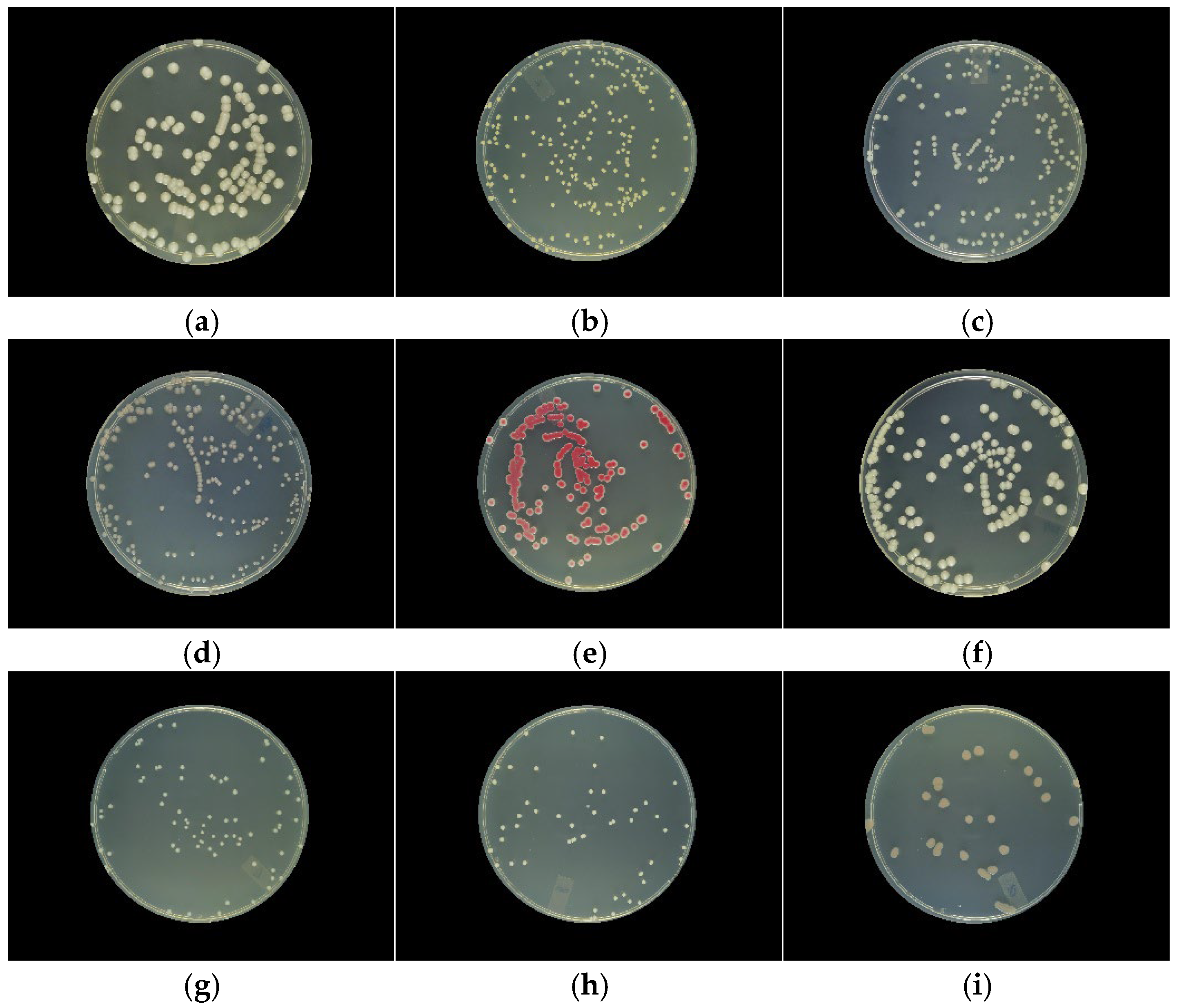 Bacterial Colony Counting and Classification System Based on Deep ...