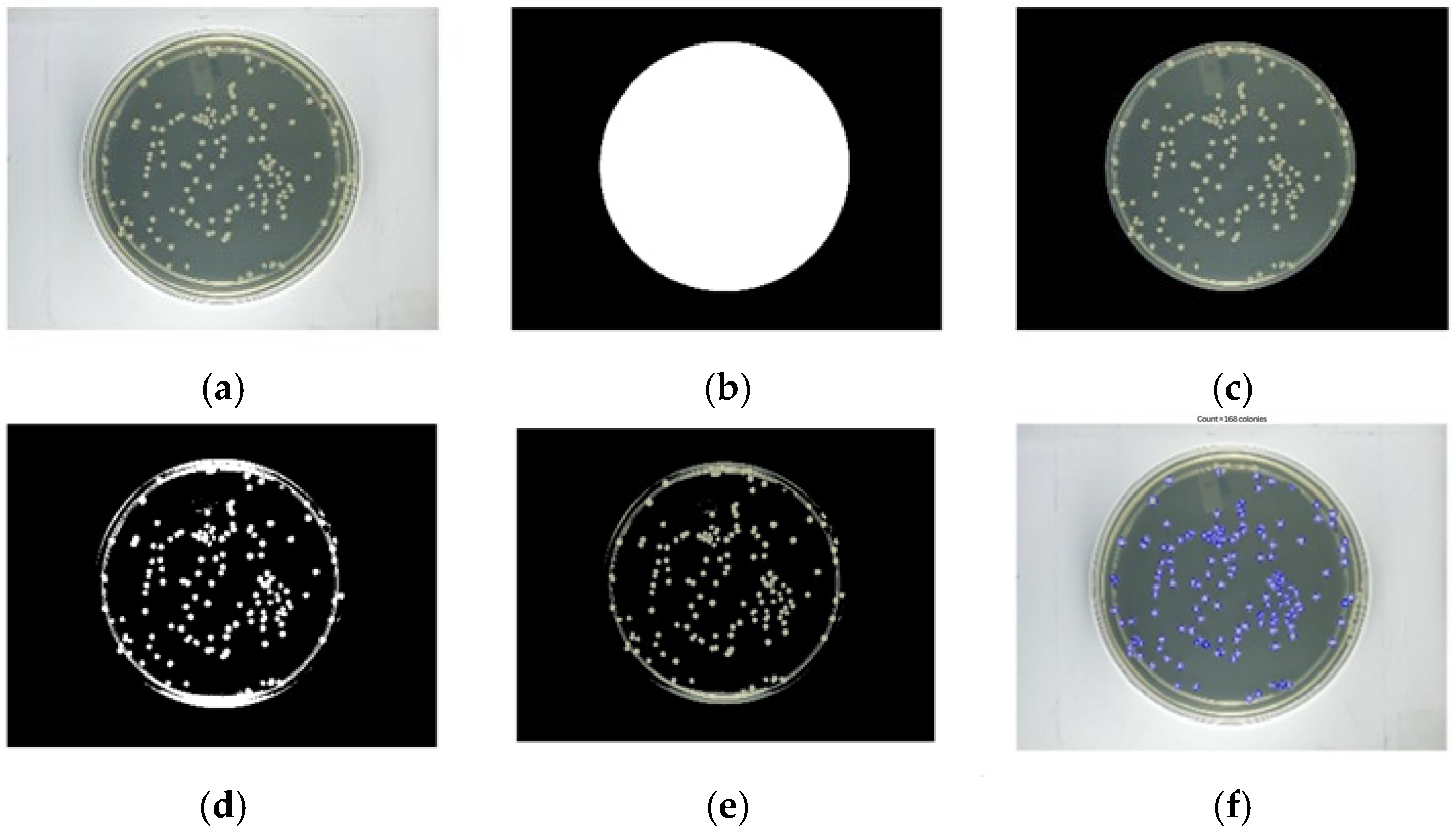 Bacterial Colony Counting and Classification System Based on Deep ...