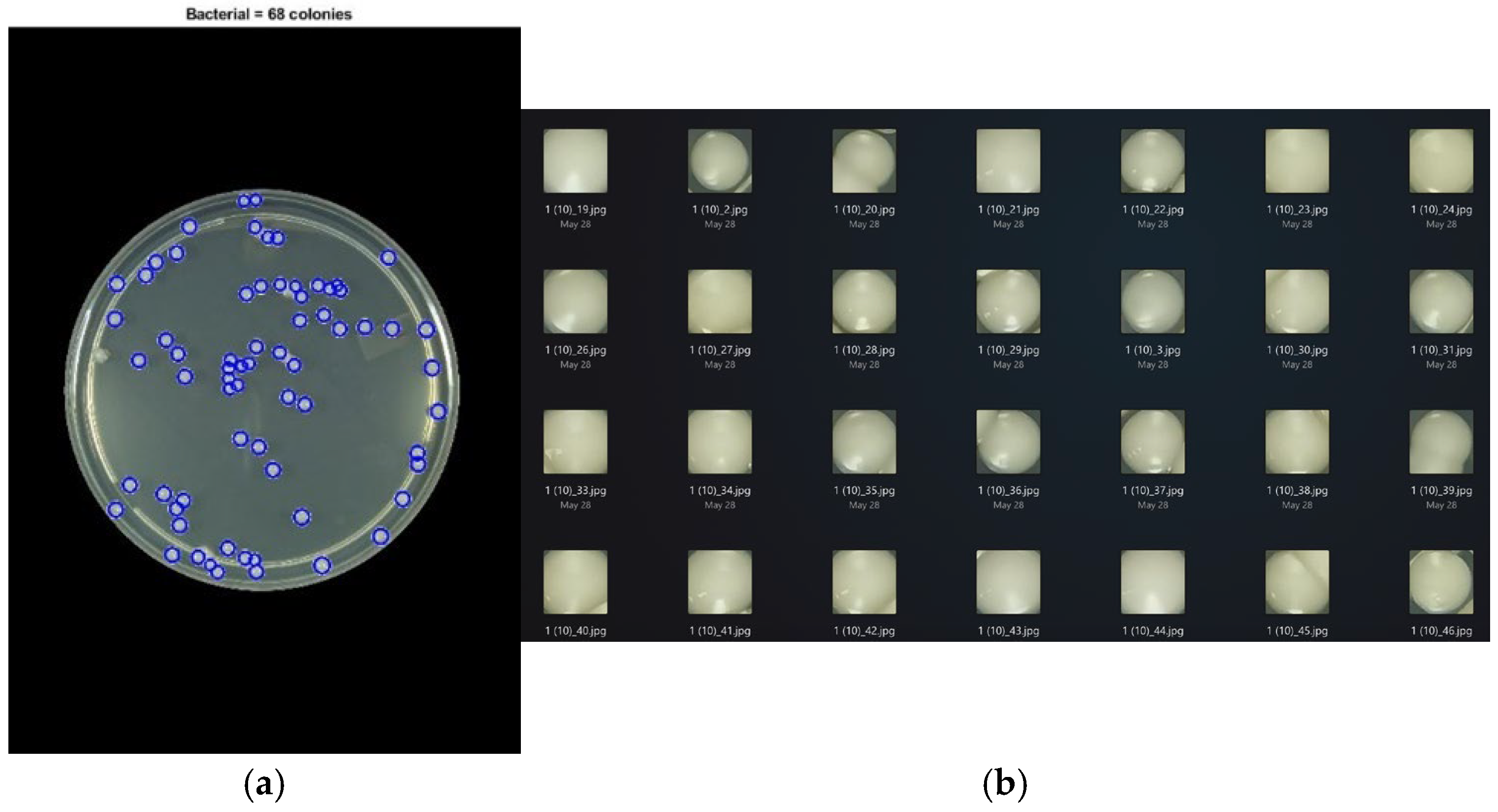 Bacterial Colony Counting and Classification System Based on Deep ...