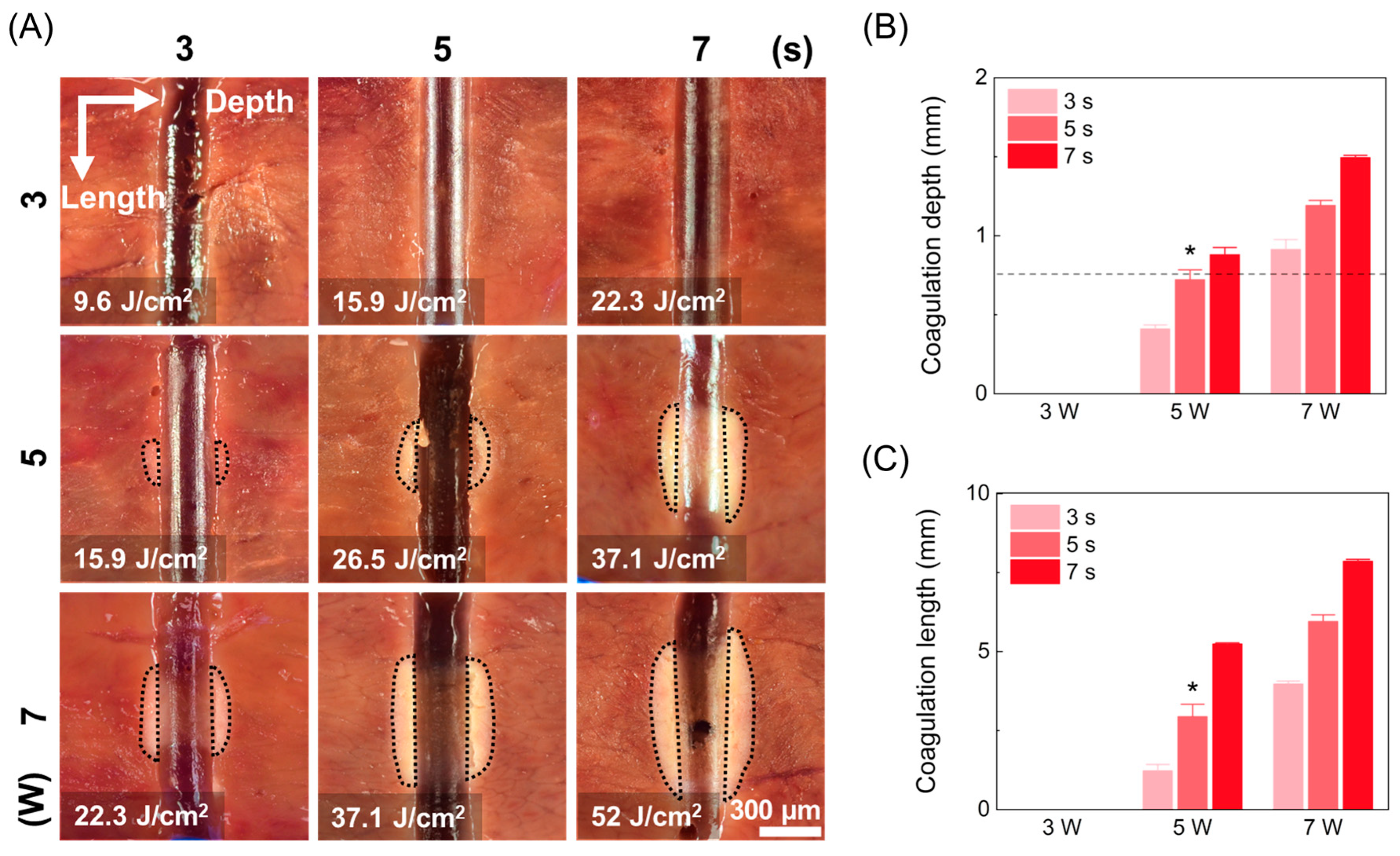 Efficacy of Photothermal Duodenal Mucosal Ablation (PDMA) on Glycemic ...