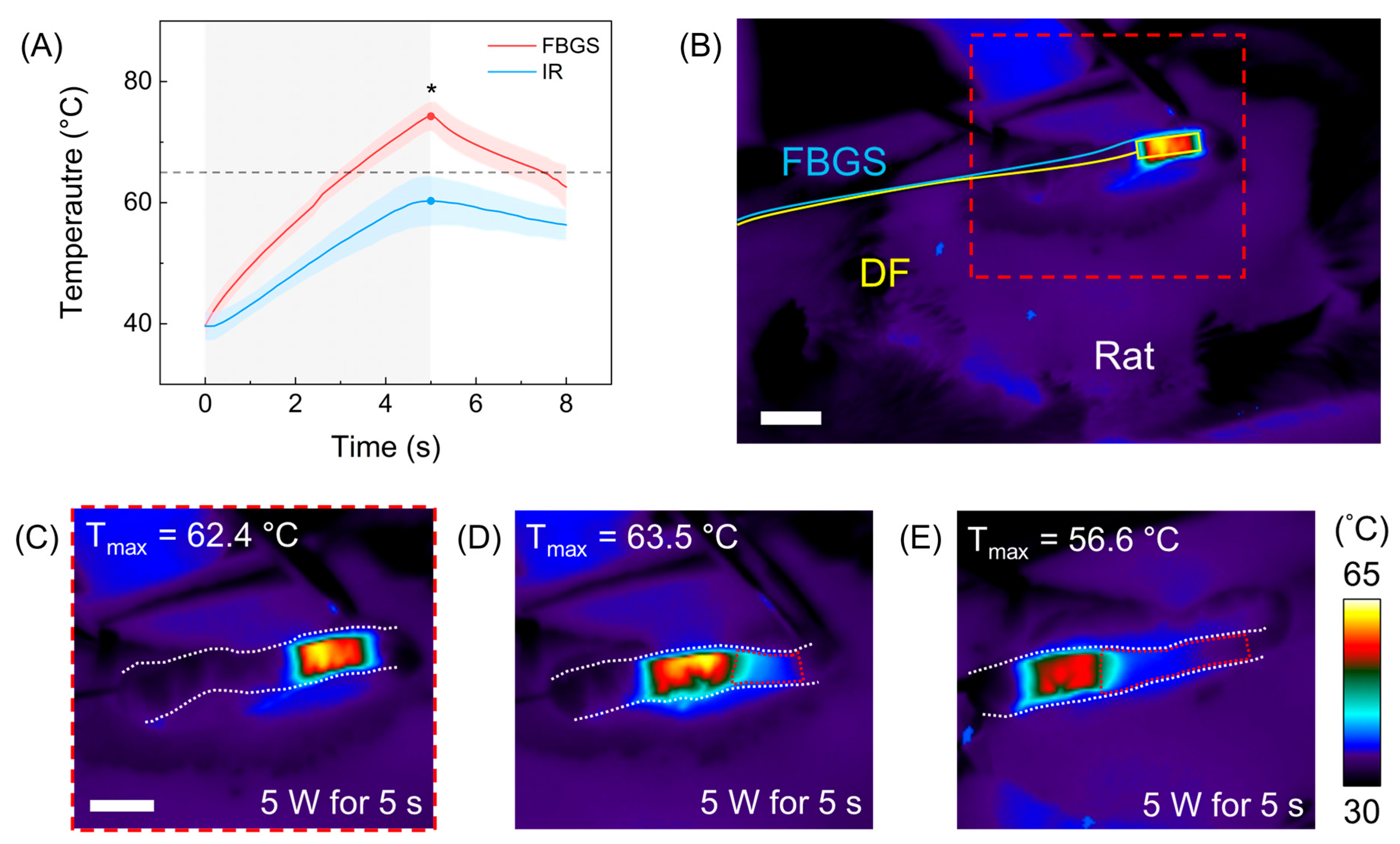 Efficacy of Photothermal Duodenal Mucosal Ablation (PDMA) on Glycemic ...