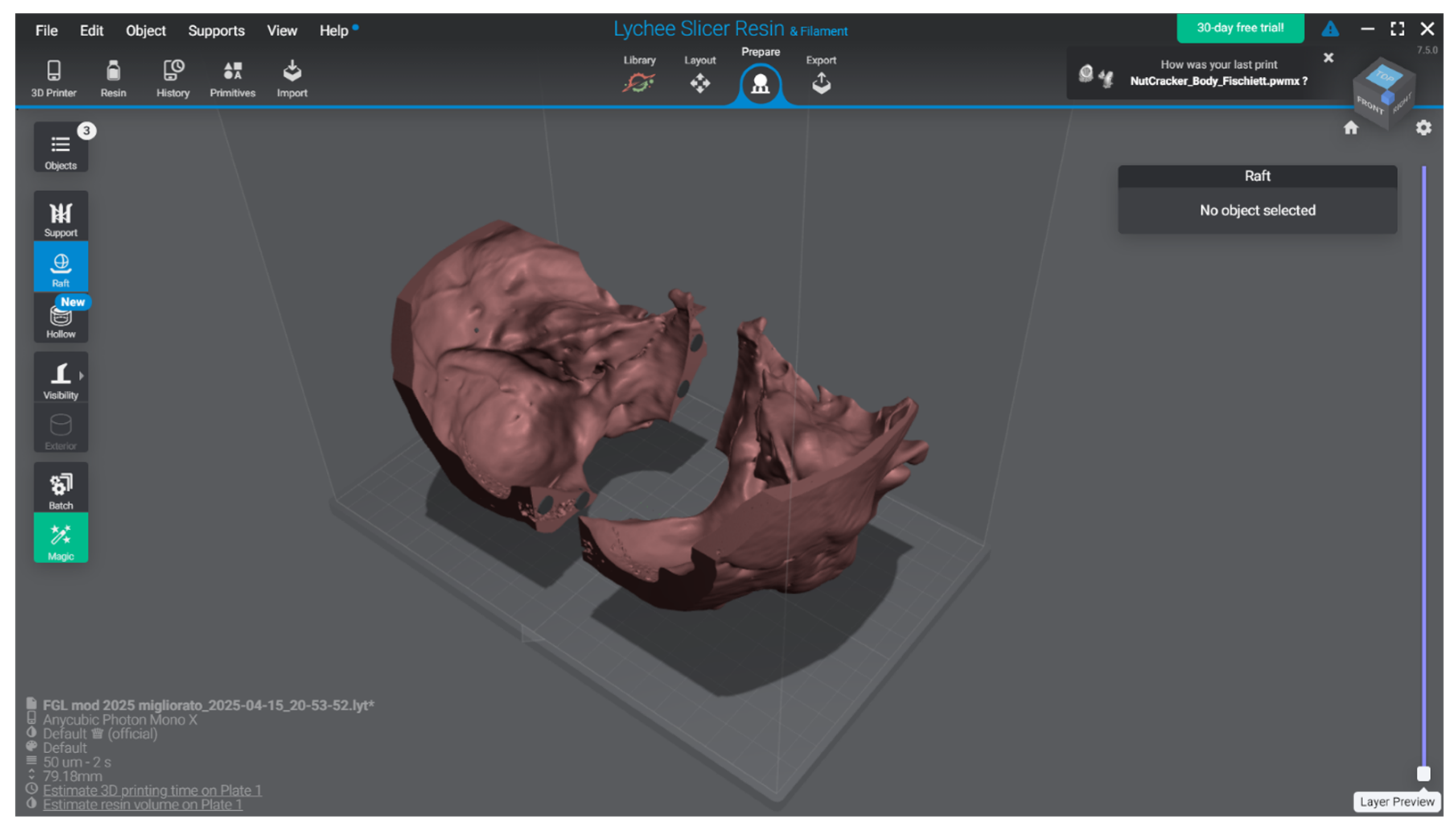 Pathology-Oriented 3D-Printed Temporal Bone Models for Cholesteatoma ...