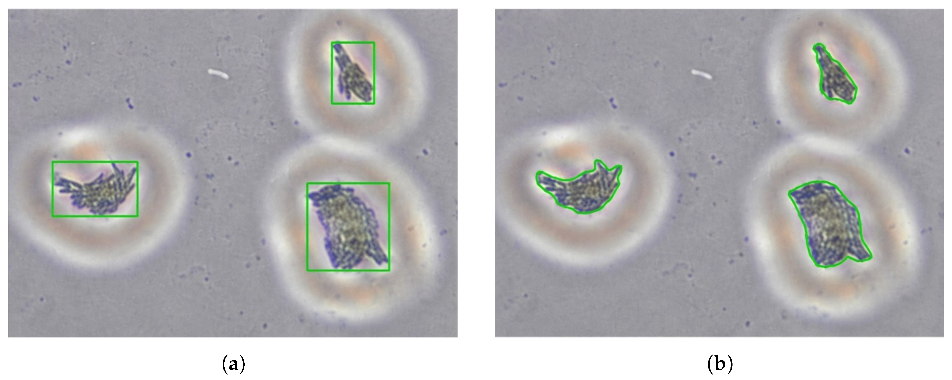 Backbone and Feature Fusion Design for YOLOv8-Based Bacterial ...