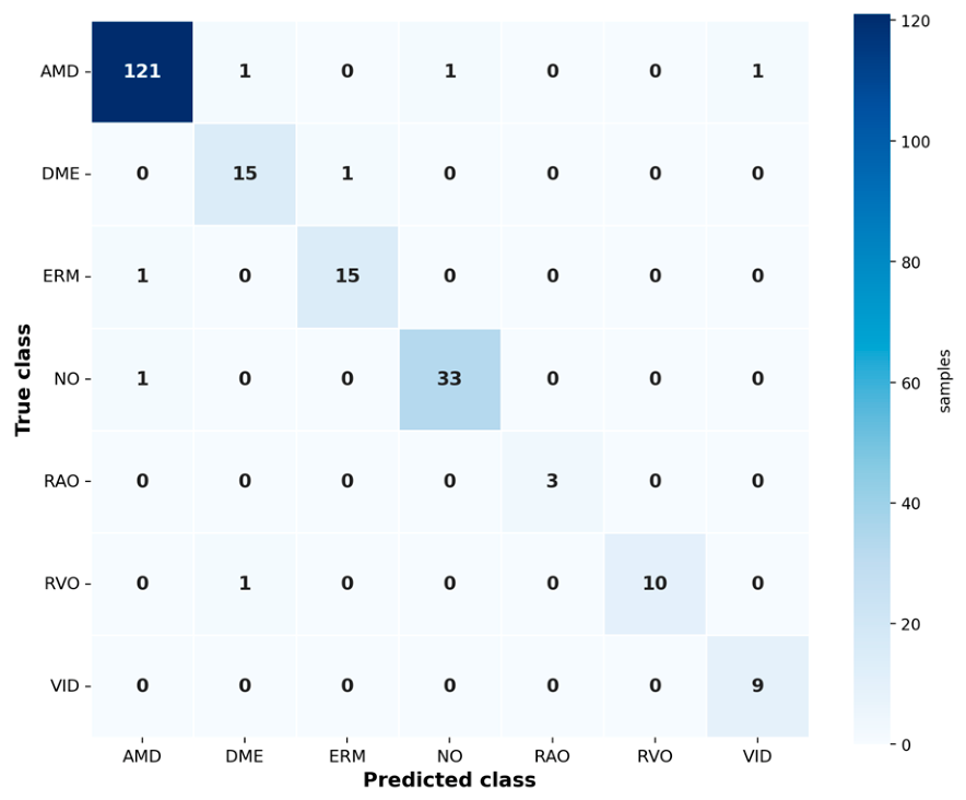 Classification of Retinal OCT Images on an Imbalanced Dataset Using a ...