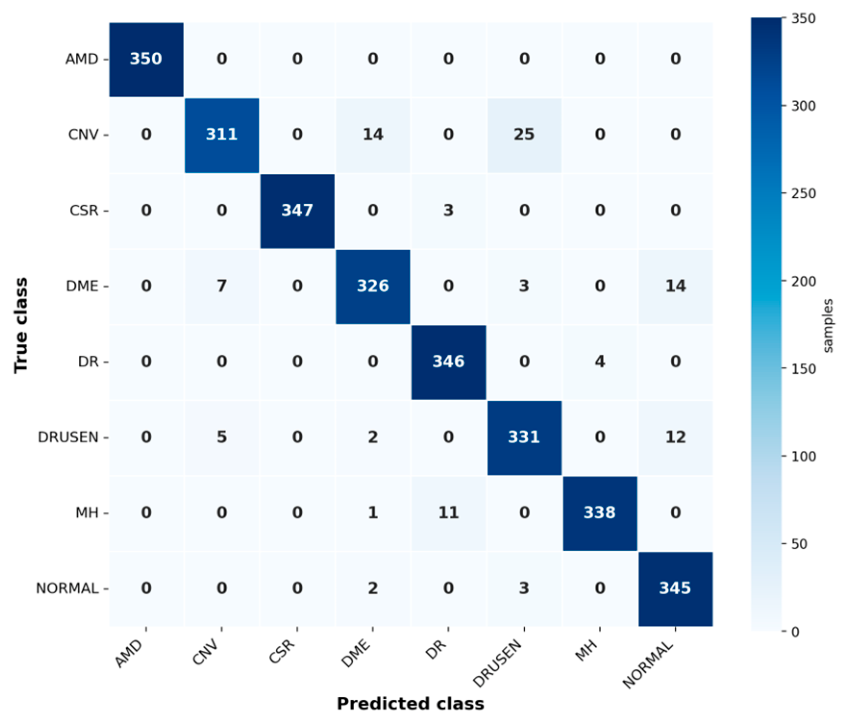 Classification of Retinal OCT Images on an Imbalanced Dataset Using a ...