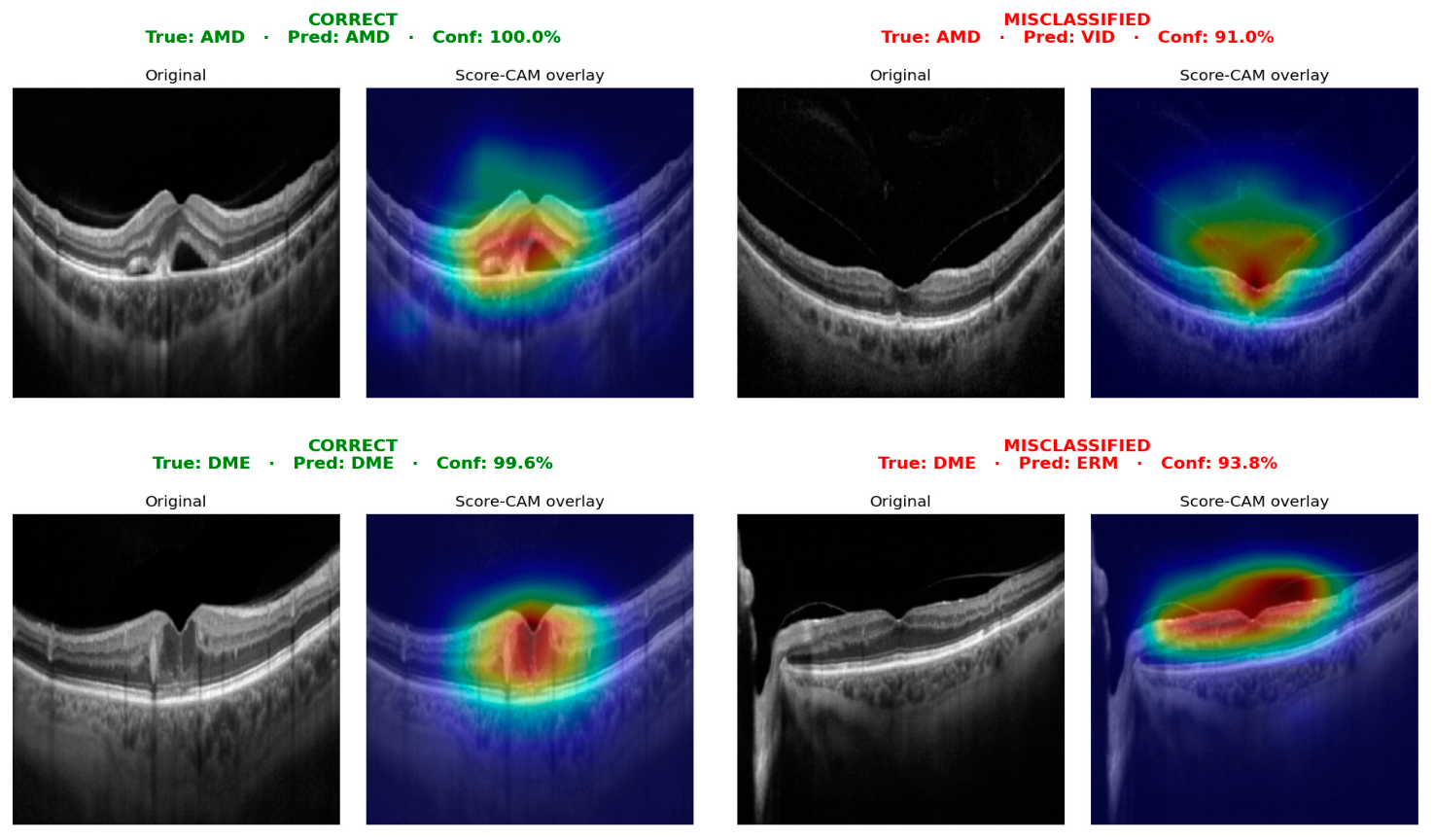 Classification of Retinal OCT Images on an Imbalanced Dataset Using a ...