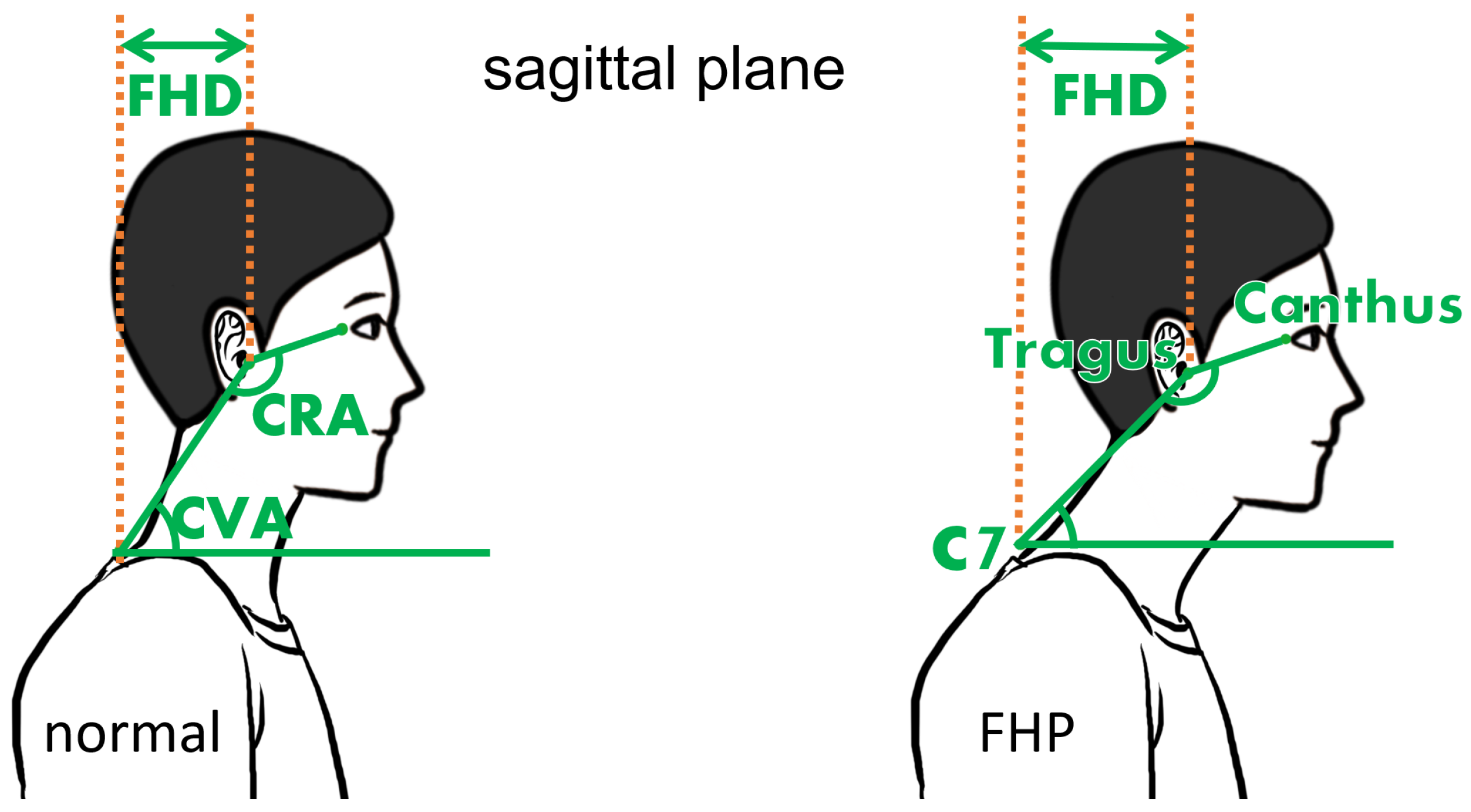 AutoMCA: A Robust Approach for Automatic Measurement of Cranial Angles