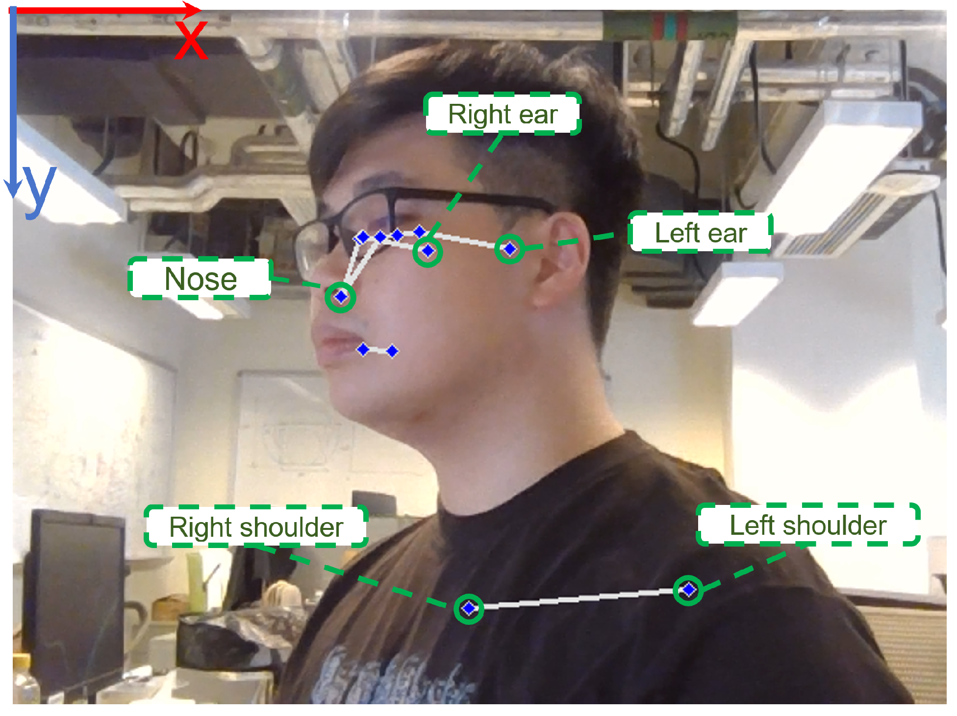 AutoMCA: A Robust Approach for Automatic Measurement of Cranial Angles