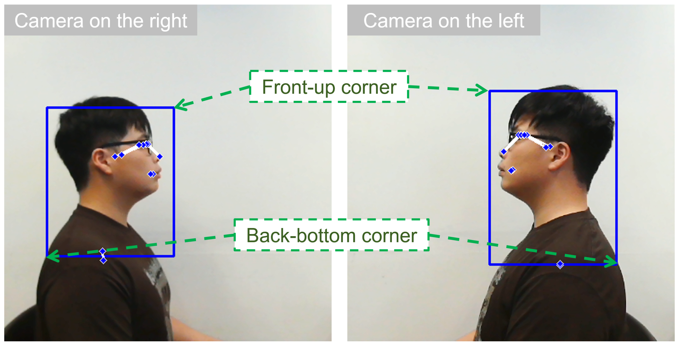 AutoMCA: A Robust Approach for Automatic Measurement of Cranial Angles