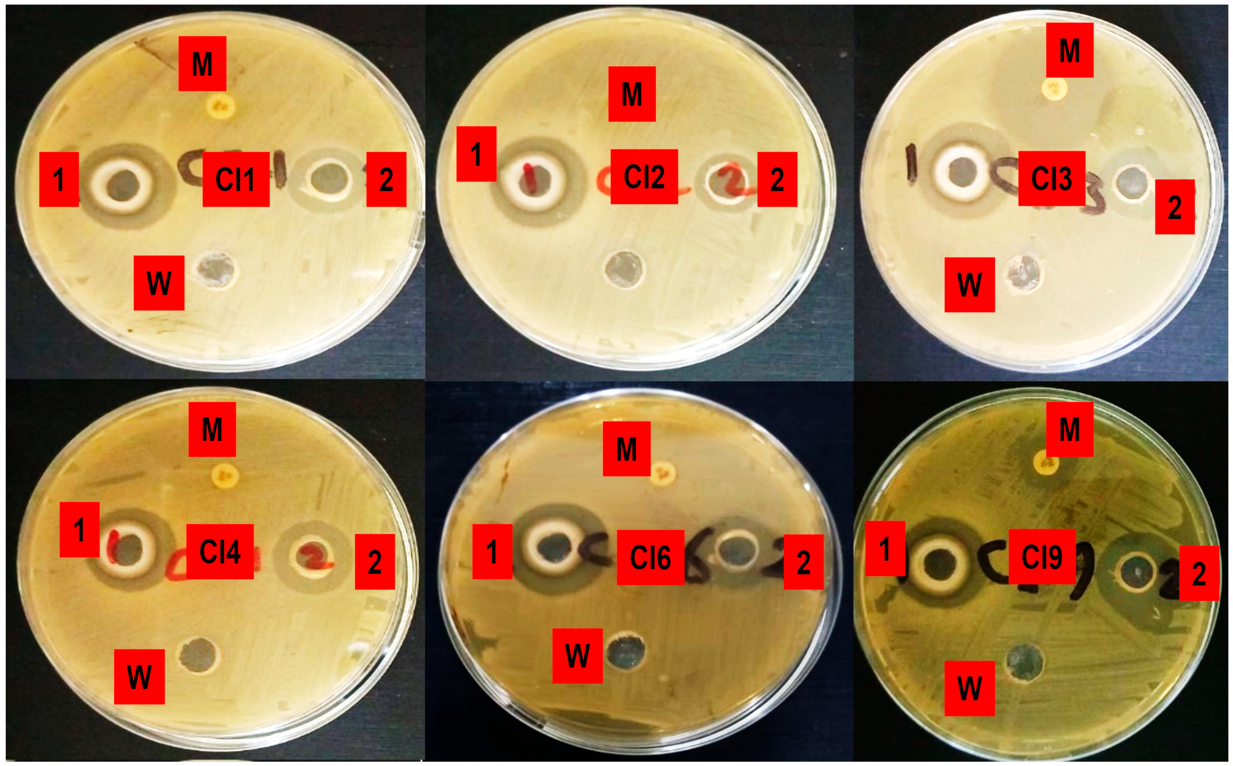Essential Oil Nanoemulsions: A Novel Strategy Against Extensively Drug ...