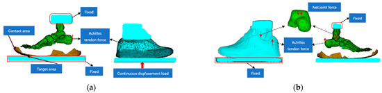 Effects of Midsole Hardness on the Mechanical Response Characteristics of the Plantar Fascia ...
