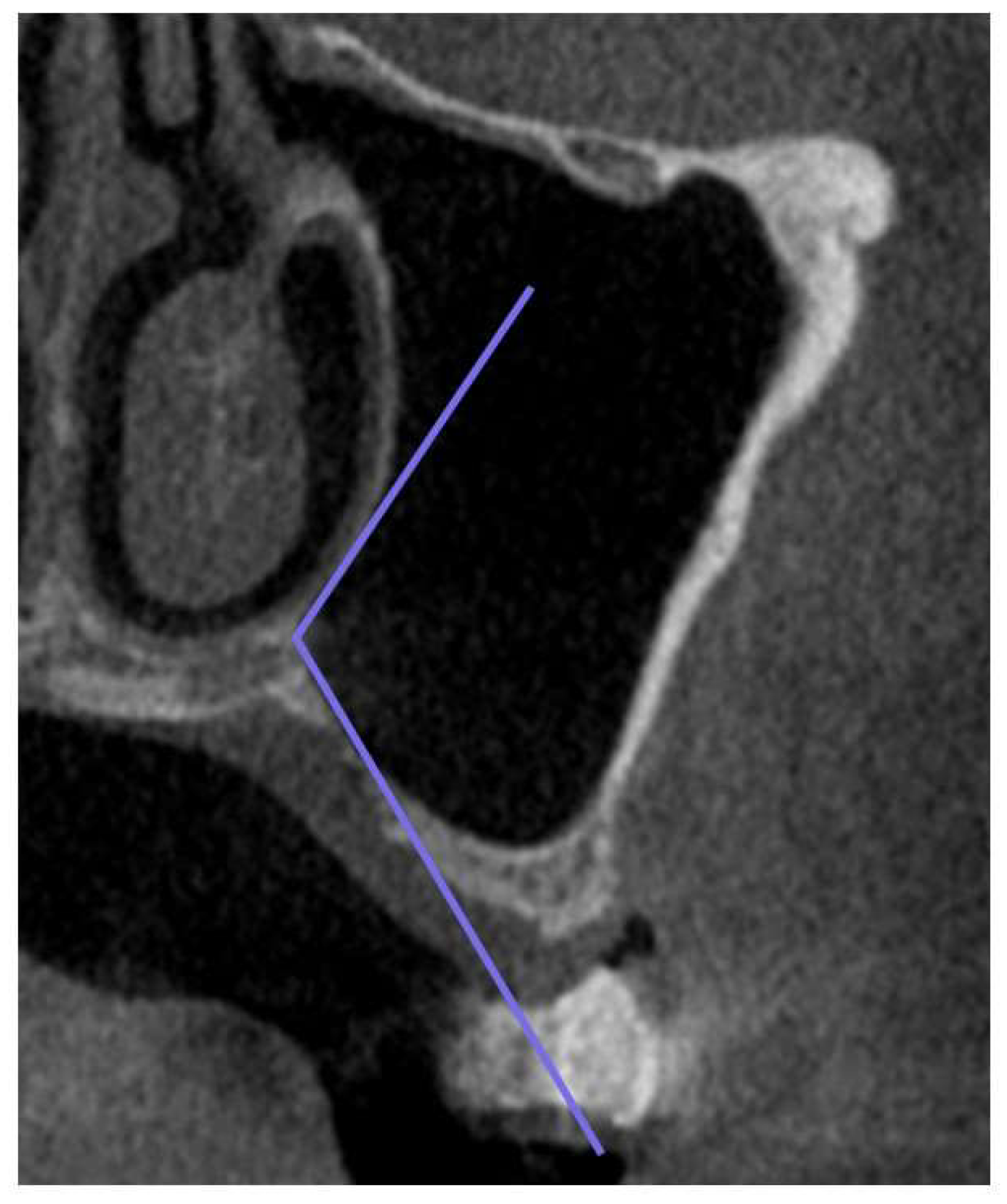 The Effectiveness and Practicality of a Novel Barrier Membrane for the ...