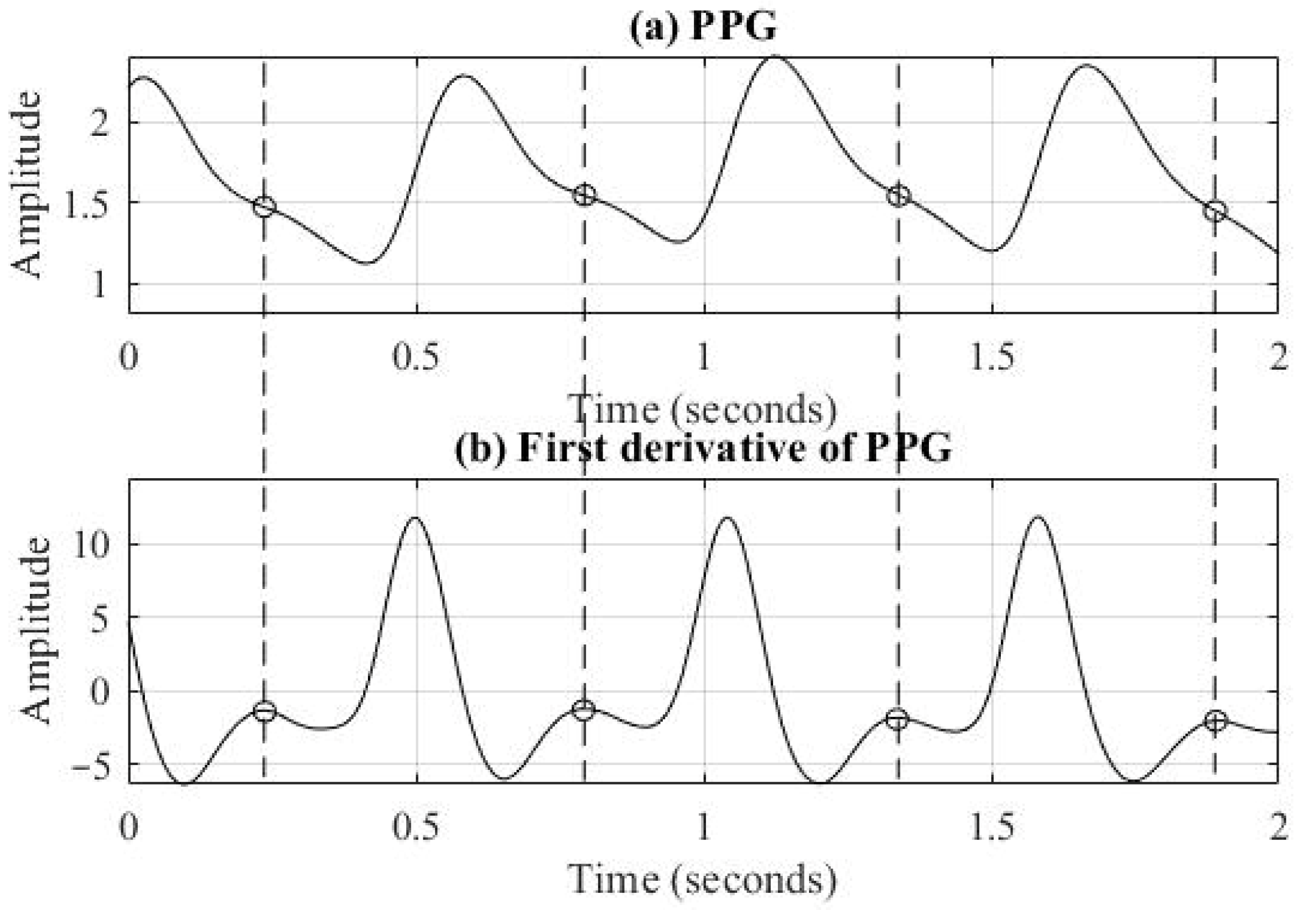 A Study on Evaluating Cardiovascular Diseases Using PPG Signals