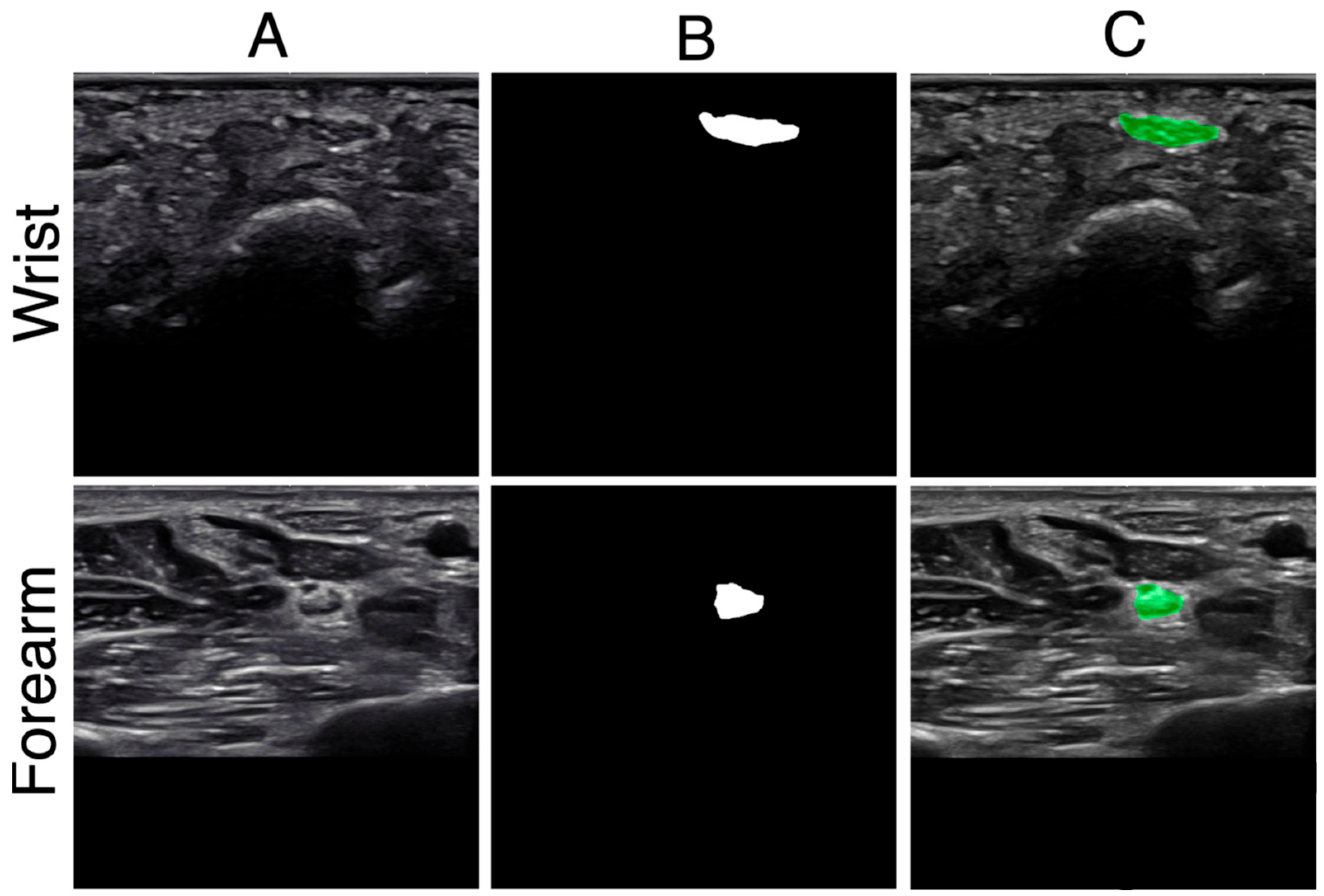 Utilization of a Deep Learning Algorithm for Automated Segmentation of ...
