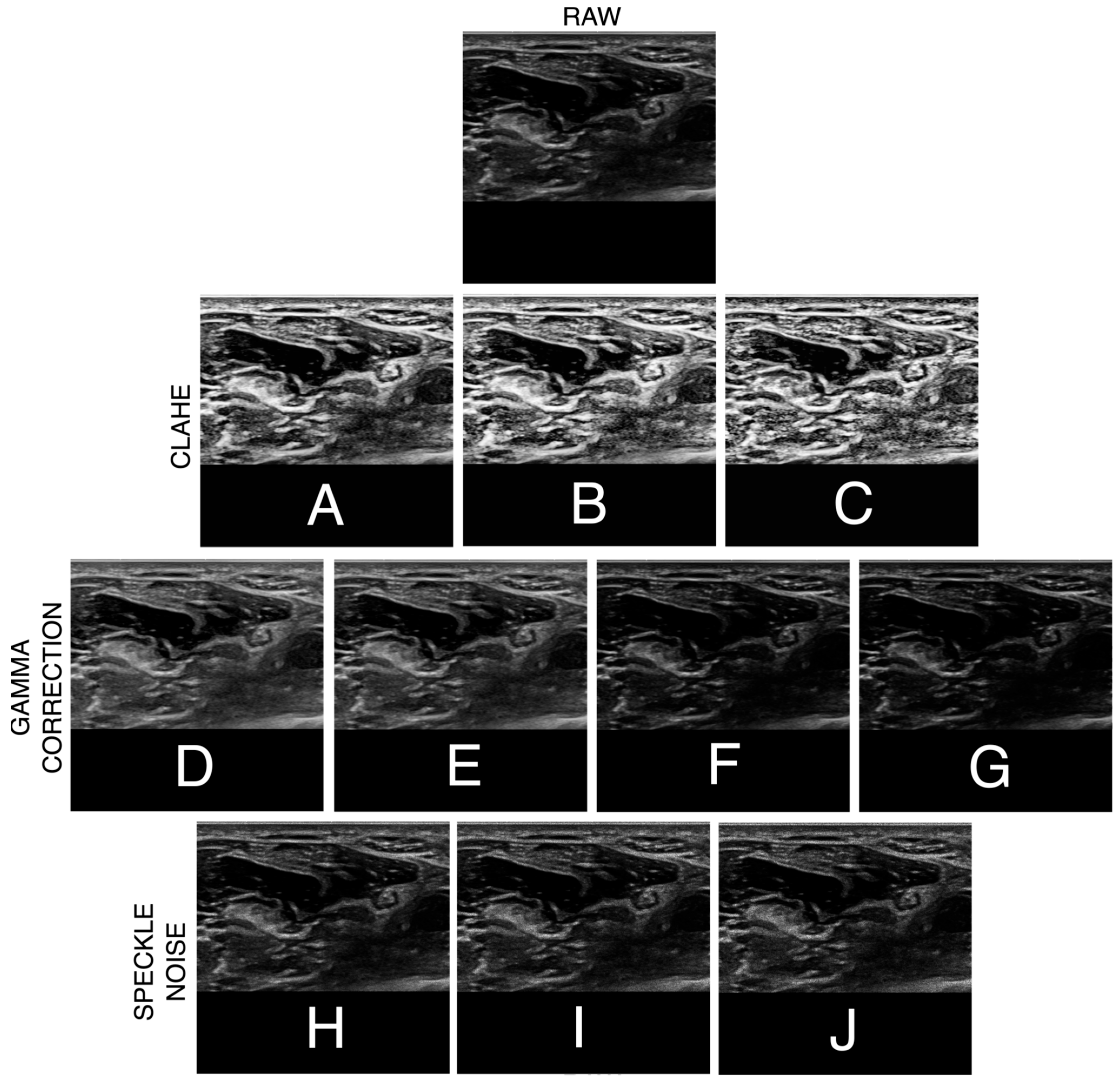 Utilization of a Deep Learning Algorithm for Automated Segmentation of ...