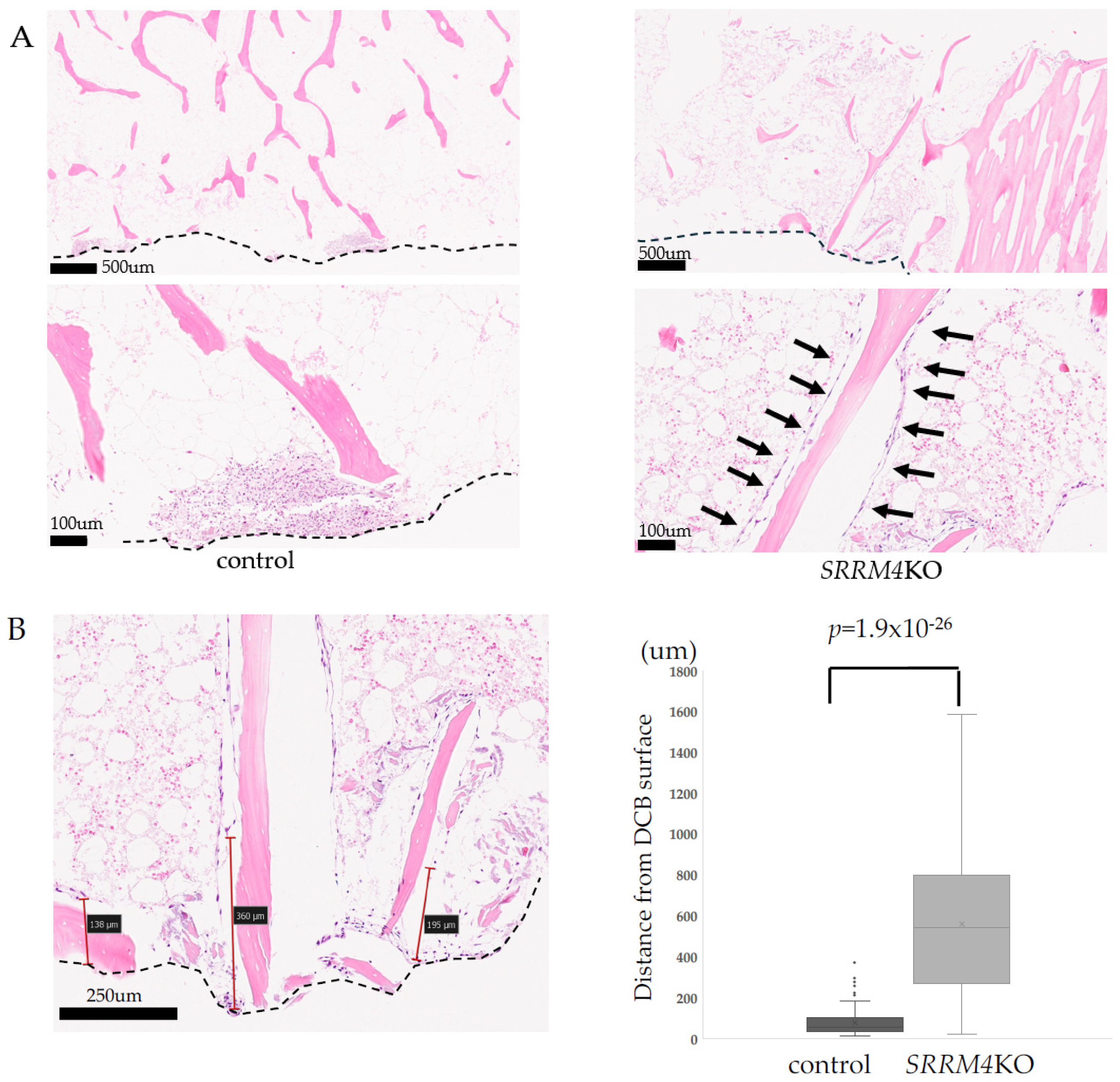 SRRM4 Knockout Helps the Human Mesenchymal Stem Cell Line to Penetrate ...