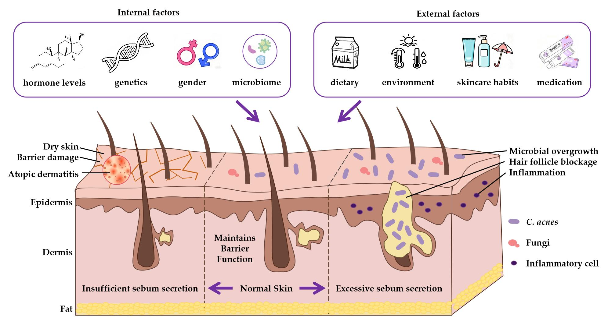A Comprehensive Review: The Bidirectional Role of Sebum in Skin Health