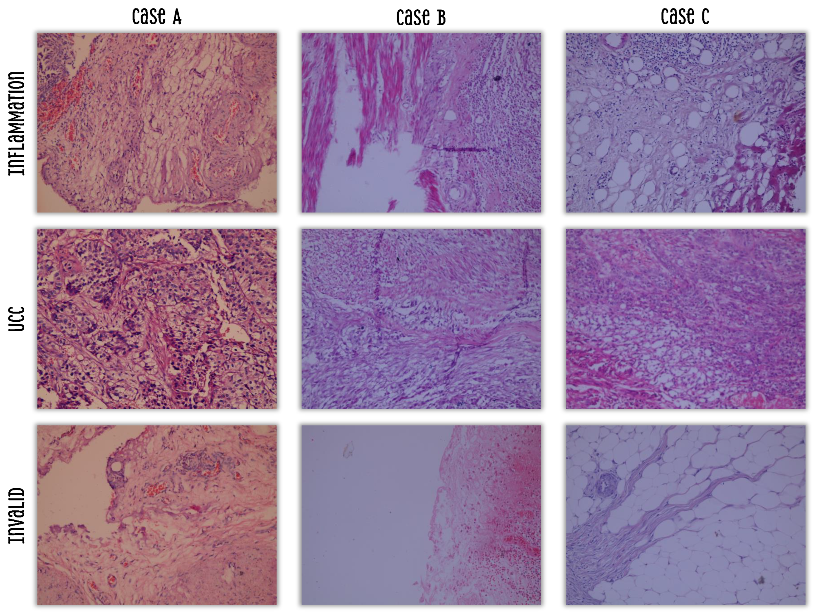 Explainable Computational Imaging for Precision Oncology: An ...