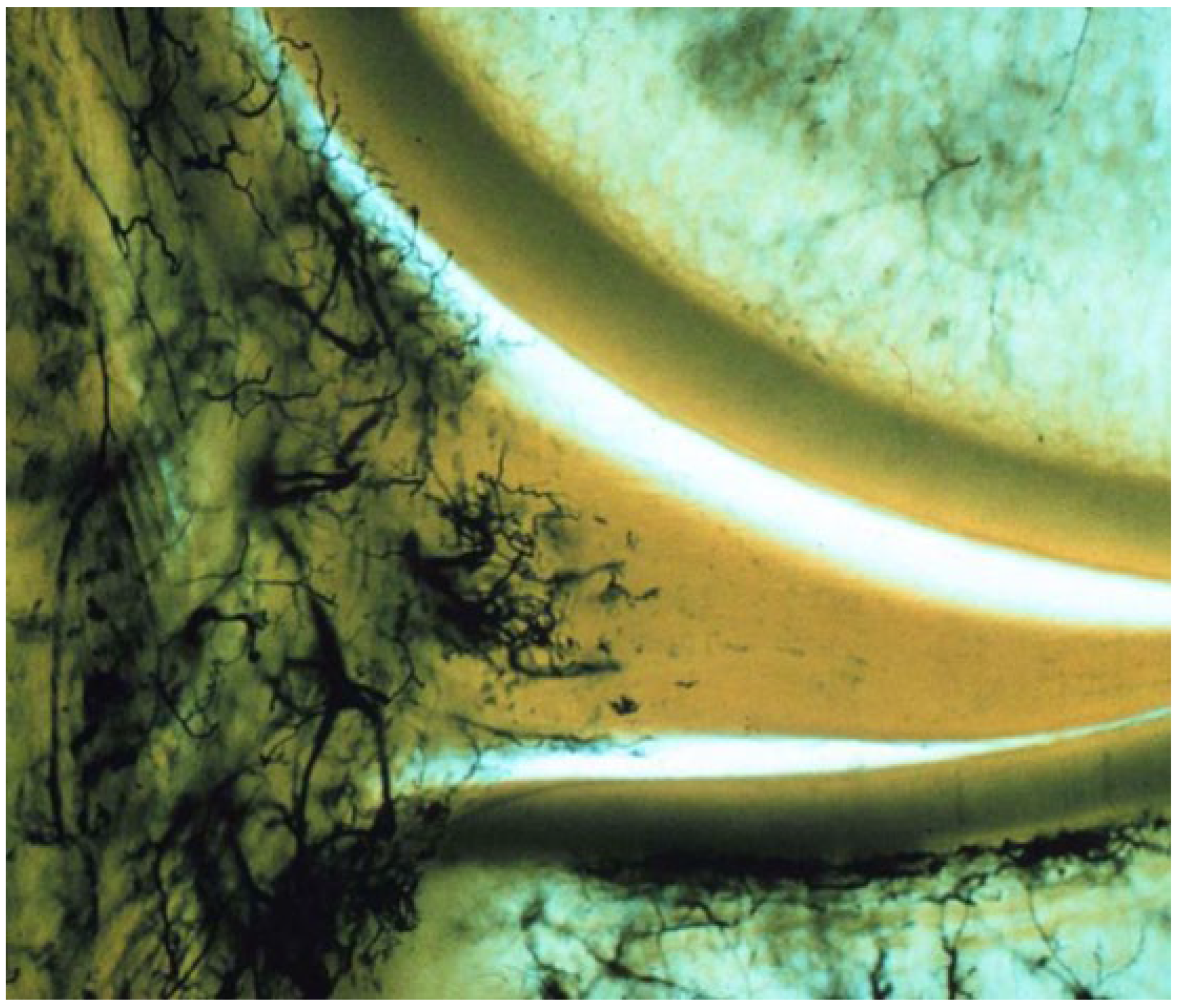 Biologic Augmentation for Meniscus Repair: A Narrative Review