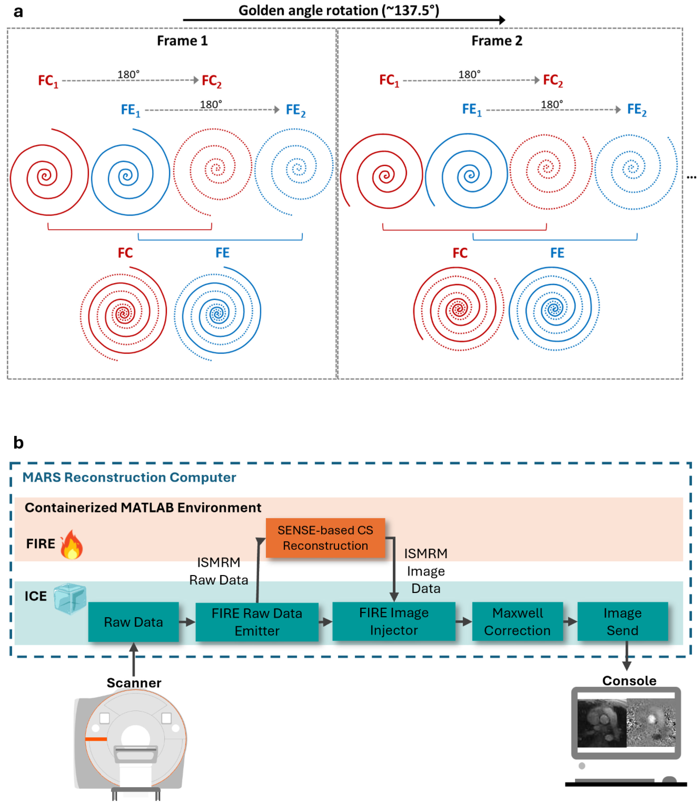 Feasibility of Golden Angle Spiral Real-Time Phase Contrast MRI at 0 ...