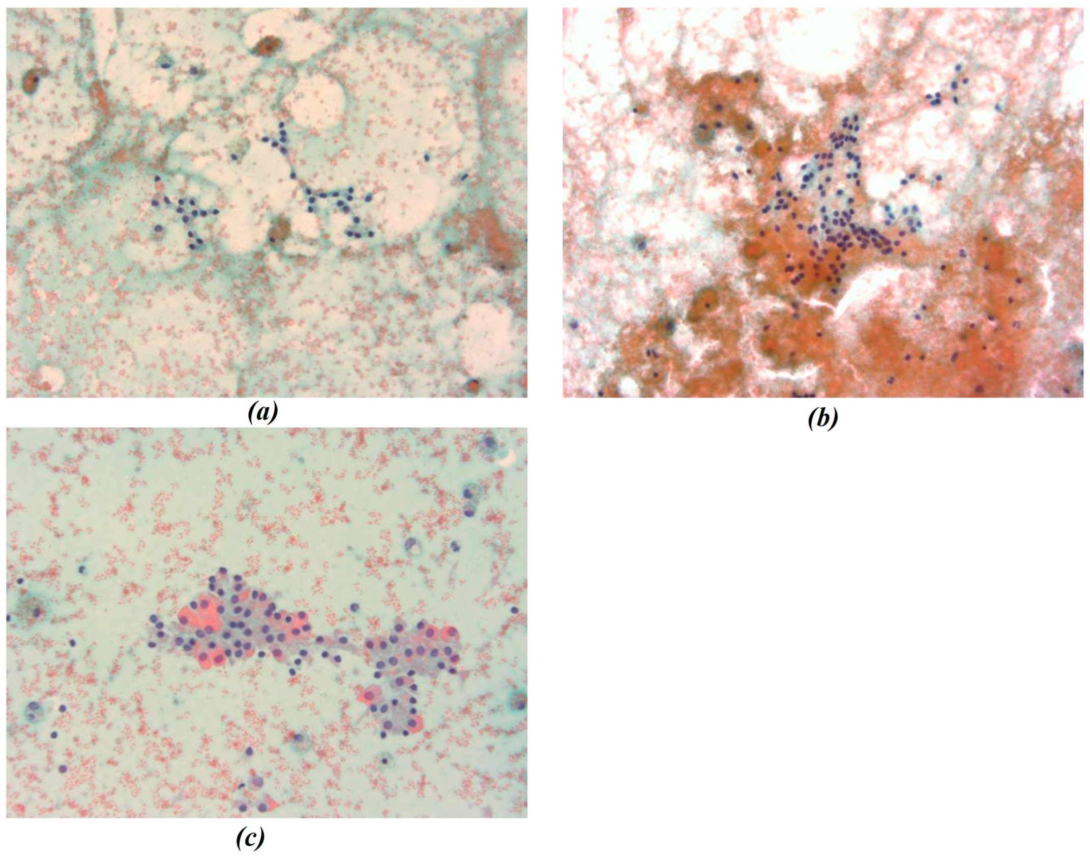 Radiomic Analysis as a Powerful Tool for Cytological Images of Benign ...