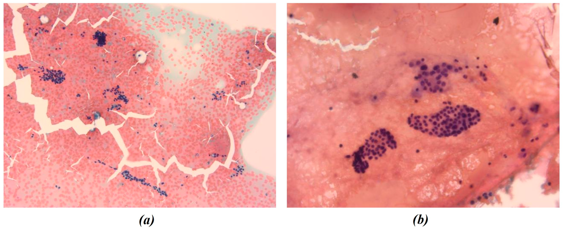 Radiomic Analysis as a Powerful Tool for Cytological Images of Benign ...