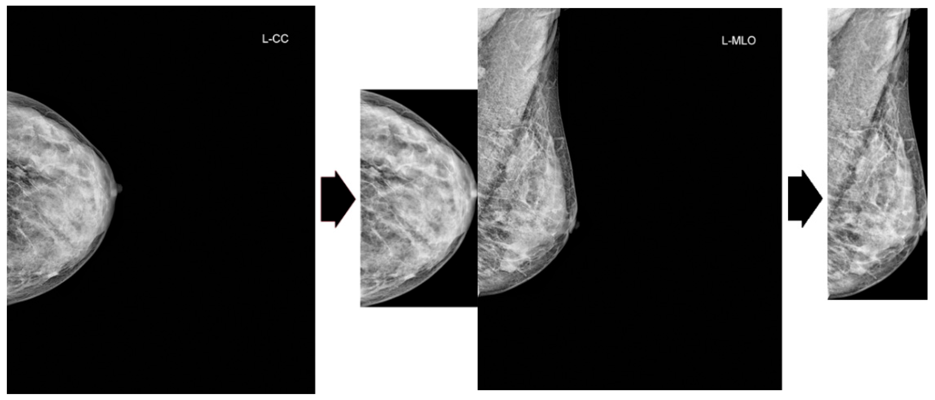 Improving Normal/Abnormal and Benign/Malignant Classifications in ...