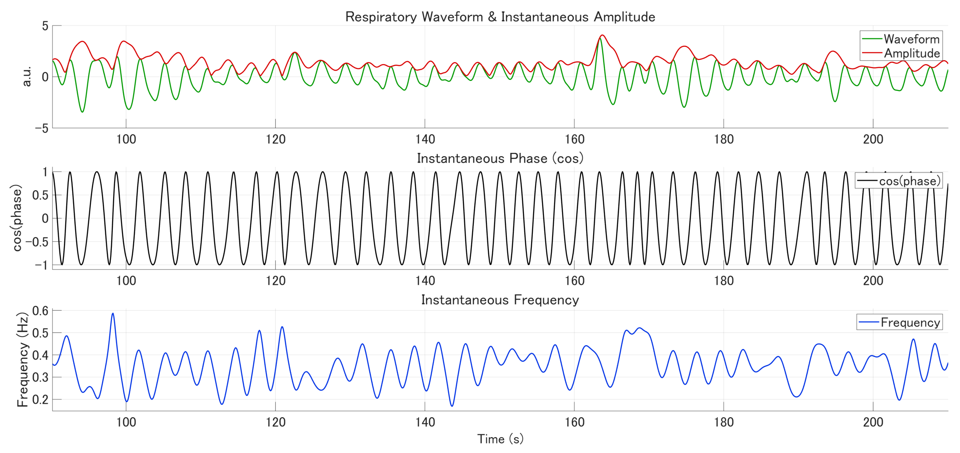 Exploratory Correlation Analysis of Respiratory Waveform, Instantaneous ...