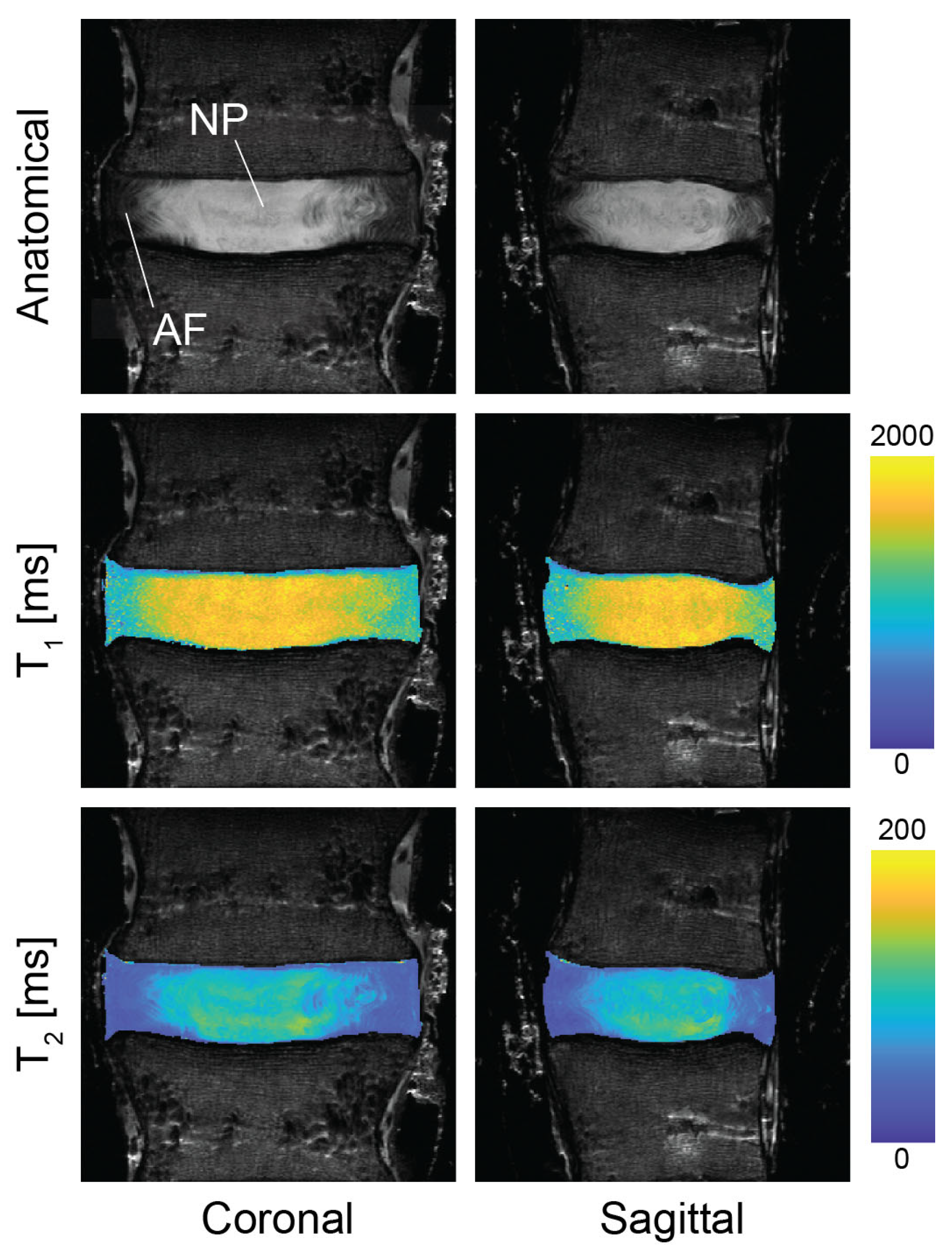 Intervertebral Disc Elastography to Relate Shear Modulus and ...