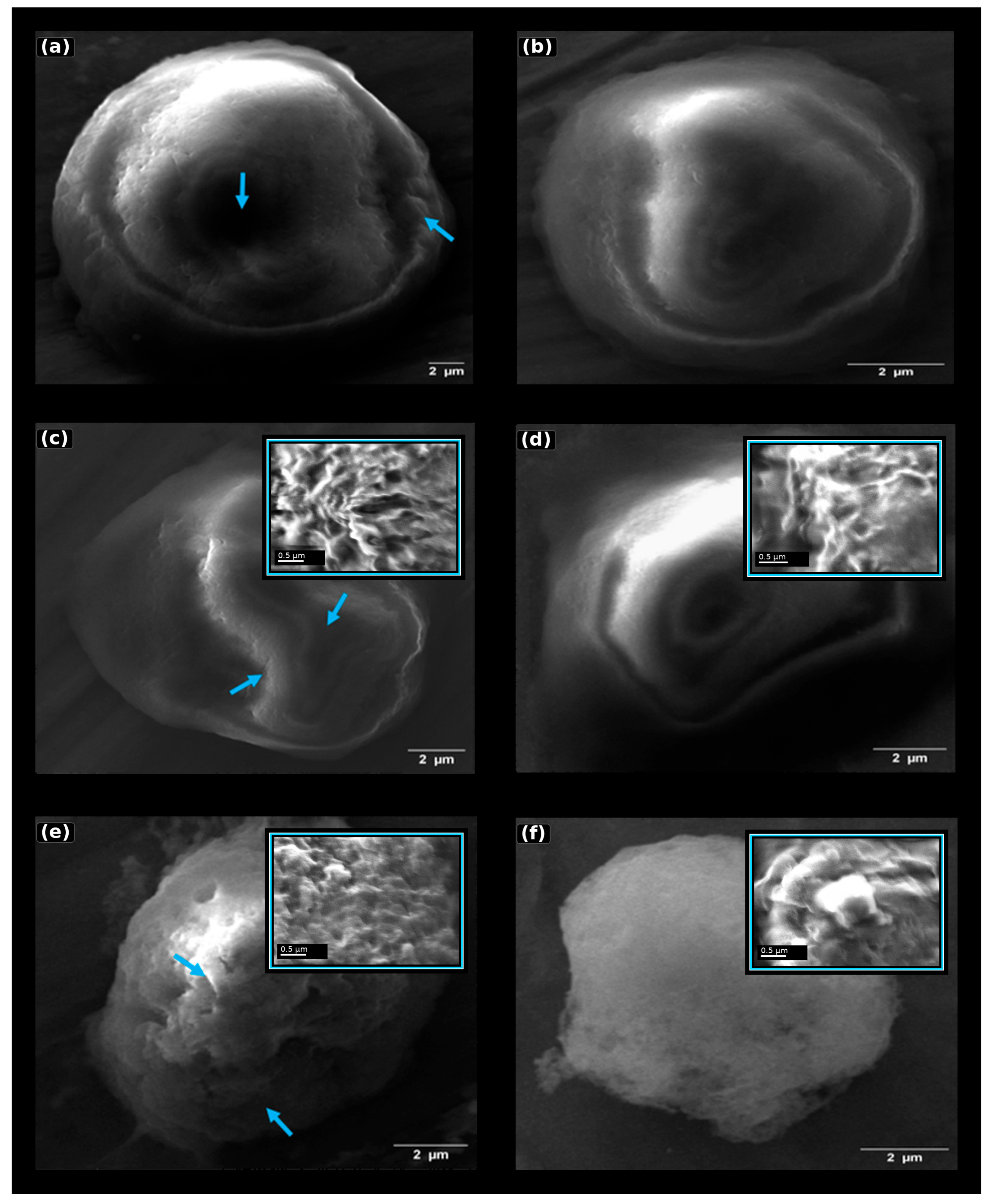An Improved SEM Preparation Workflow for Plasma Membrane Imaging in ...