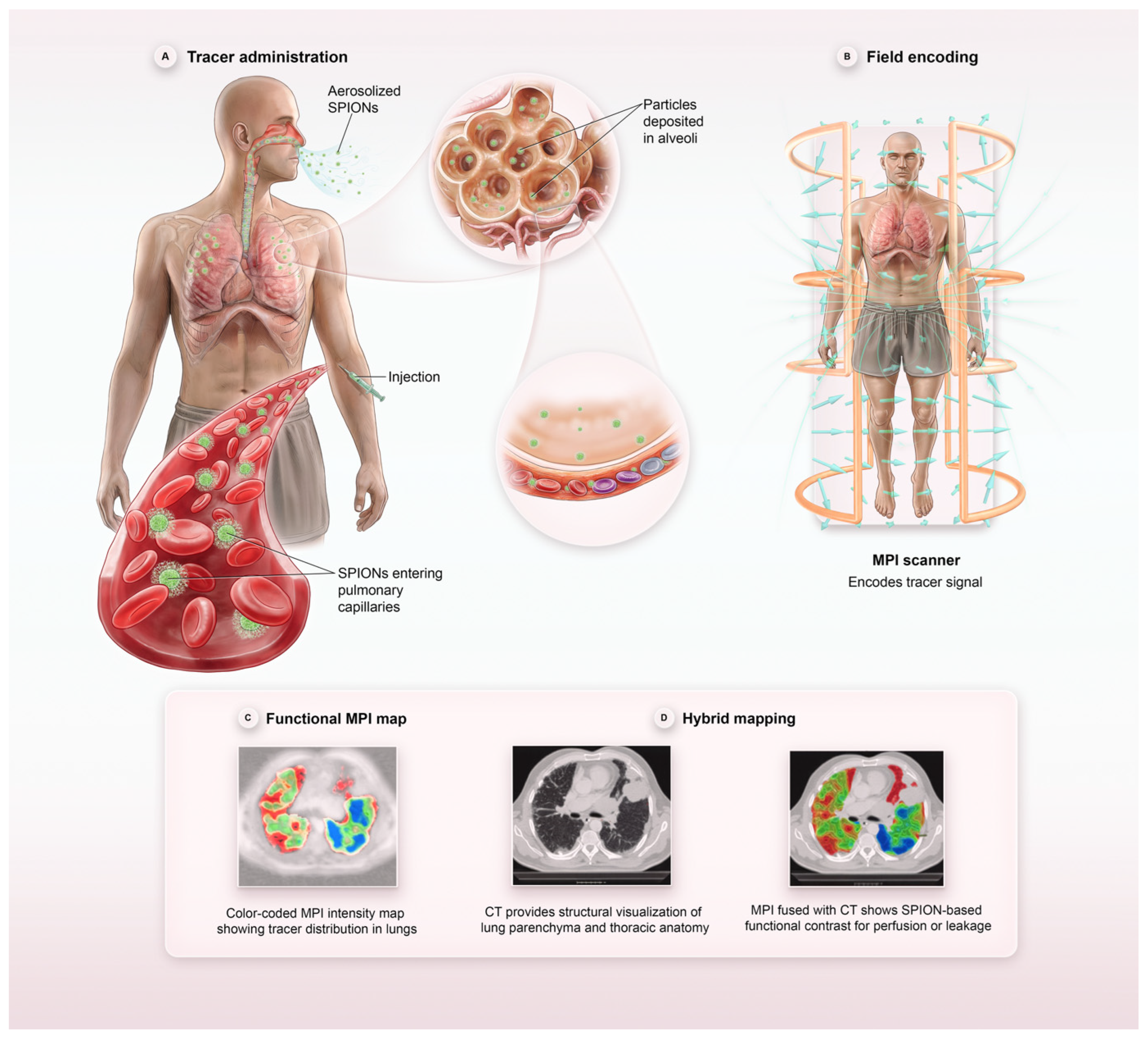 Magnetic Particle Imaging for Pulmonary Applications: Technological ...