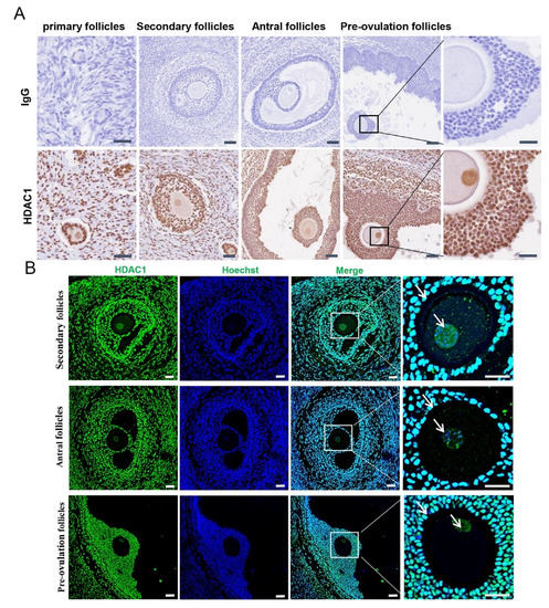 HDAC1 in the Ovarian Granulosa Cells of Tan Sheep Improves Cumulus Cell ...