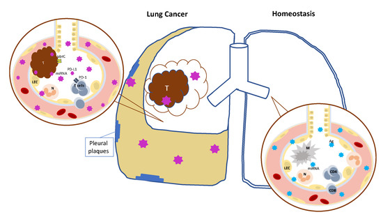 Extracellular Vesicles in Lung Cancer: Bystanders or Main Characters?