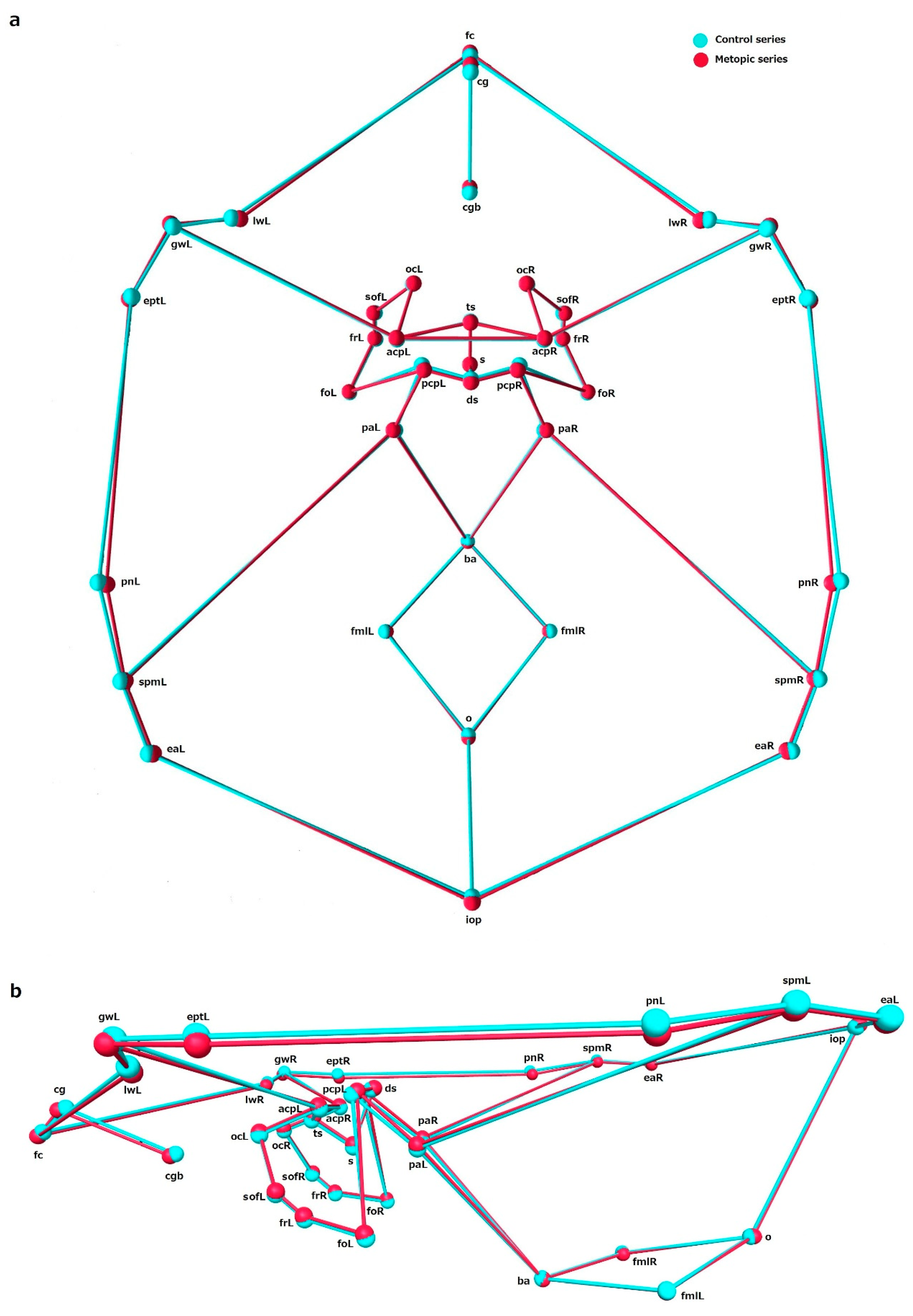 Basis Cranii Interna in Metopism: A Comparative Geometric Morphometric ...