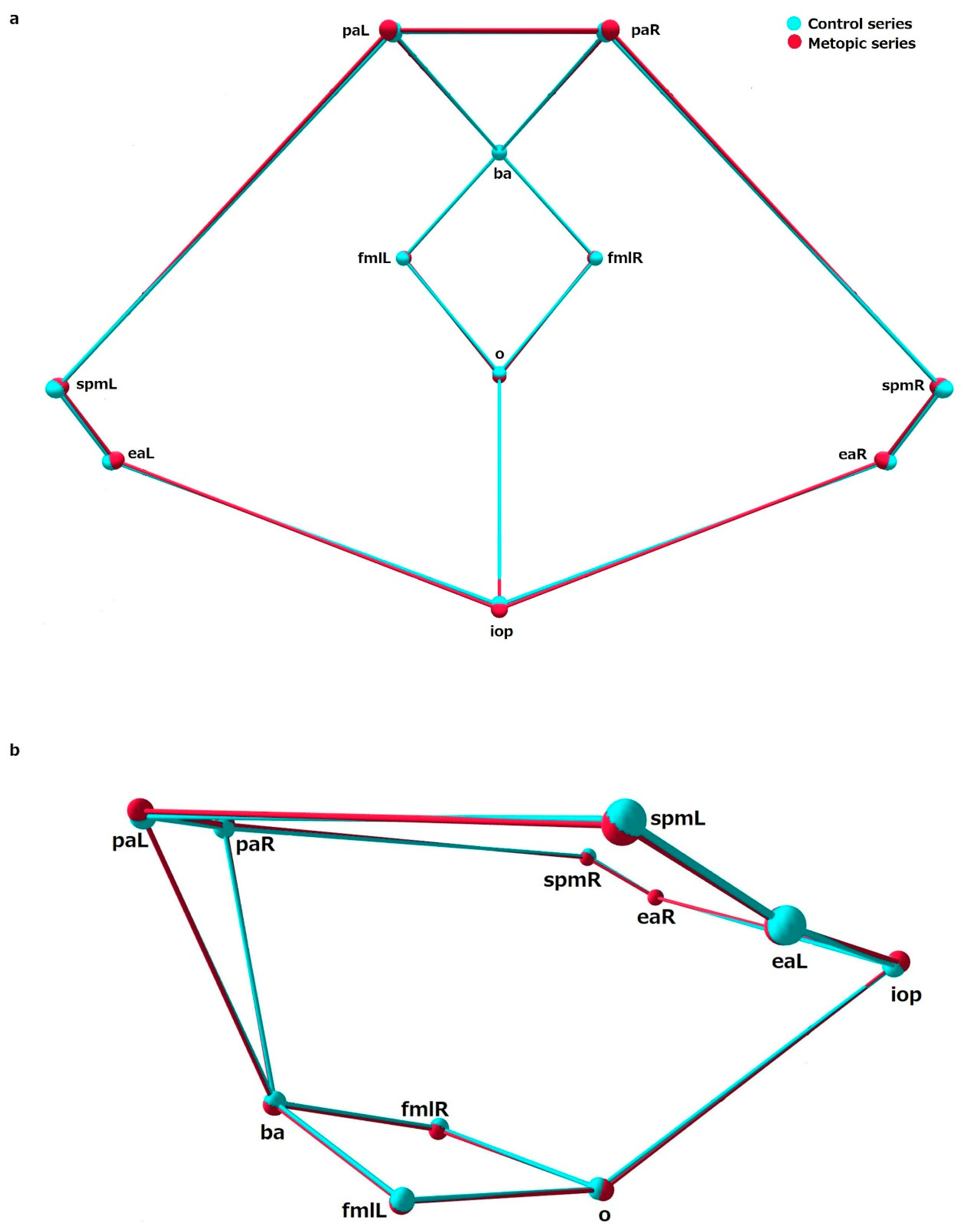 Basis Cranii Interna in Metopism: A Comparative Geometric Morphometric ...