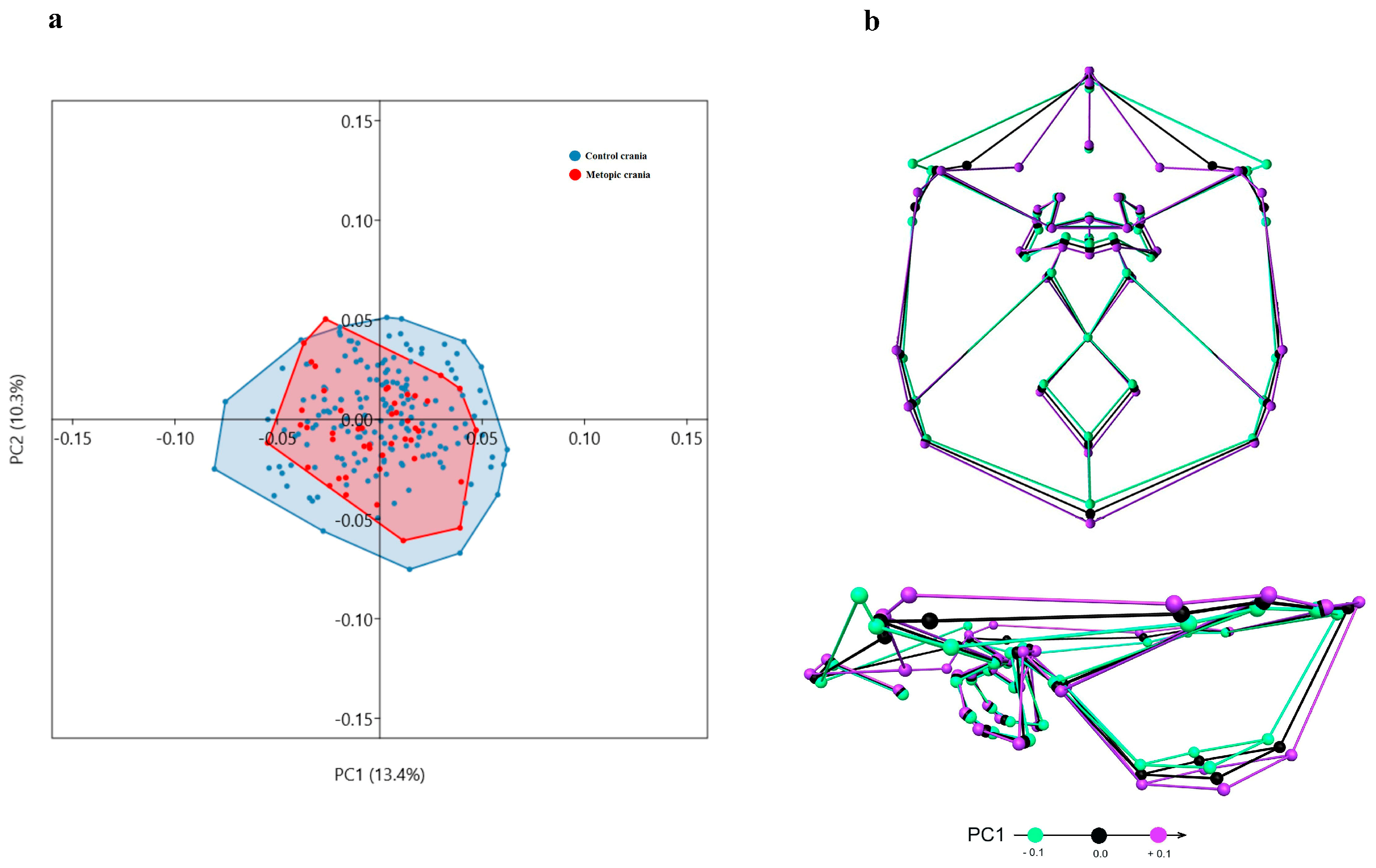 Basis Cranii Interna in Metopism: A Comparative Geometric Morphometric ...