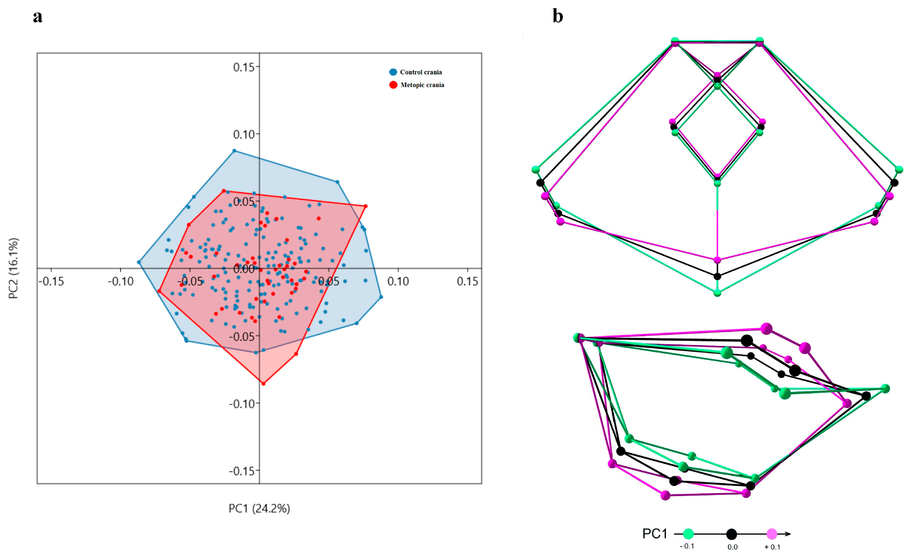 Basis Cranii Interna in Metopism: A Comparative Geometric Morphometric ...