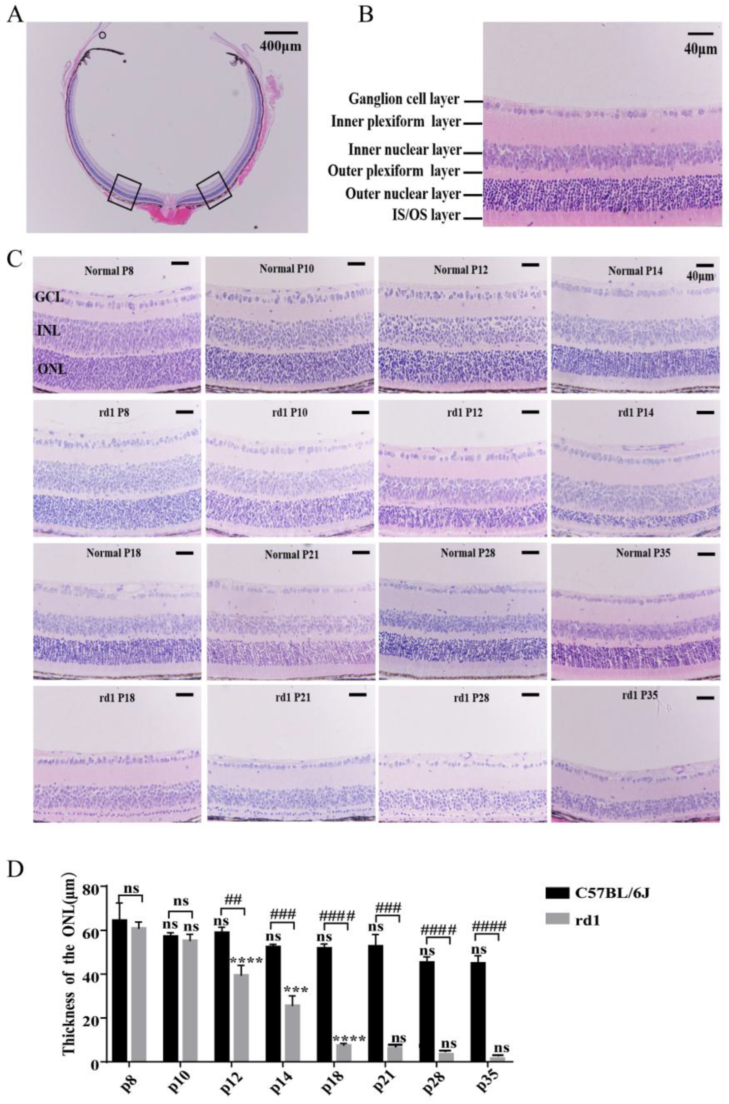 RNA Sequencing and Targeted Knockdown Reveal miR-142a-5p as a Driver of ...