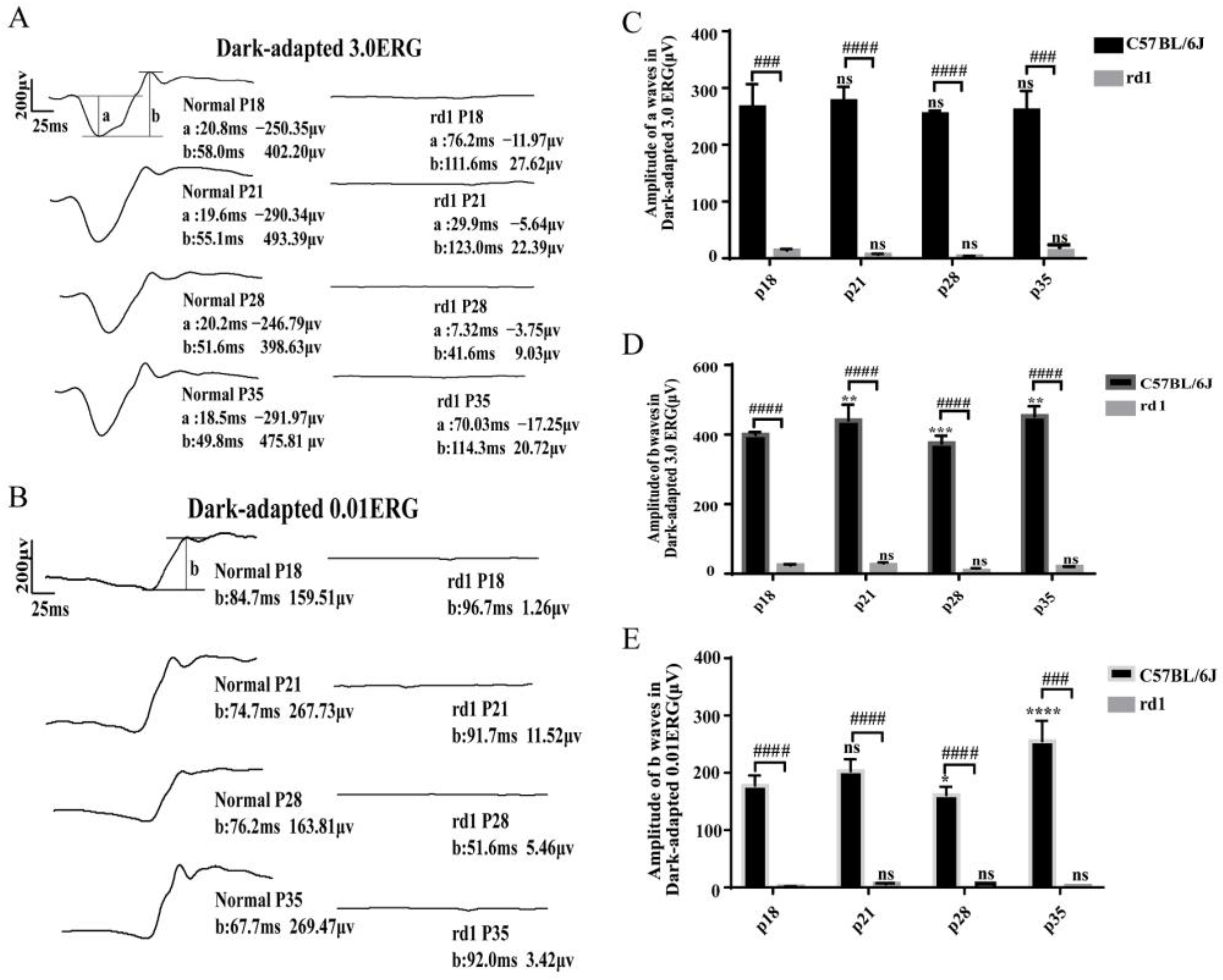 RNA Sequencing and Targeted Knockdown Reveal miR-142a-5p as a Driver of ...