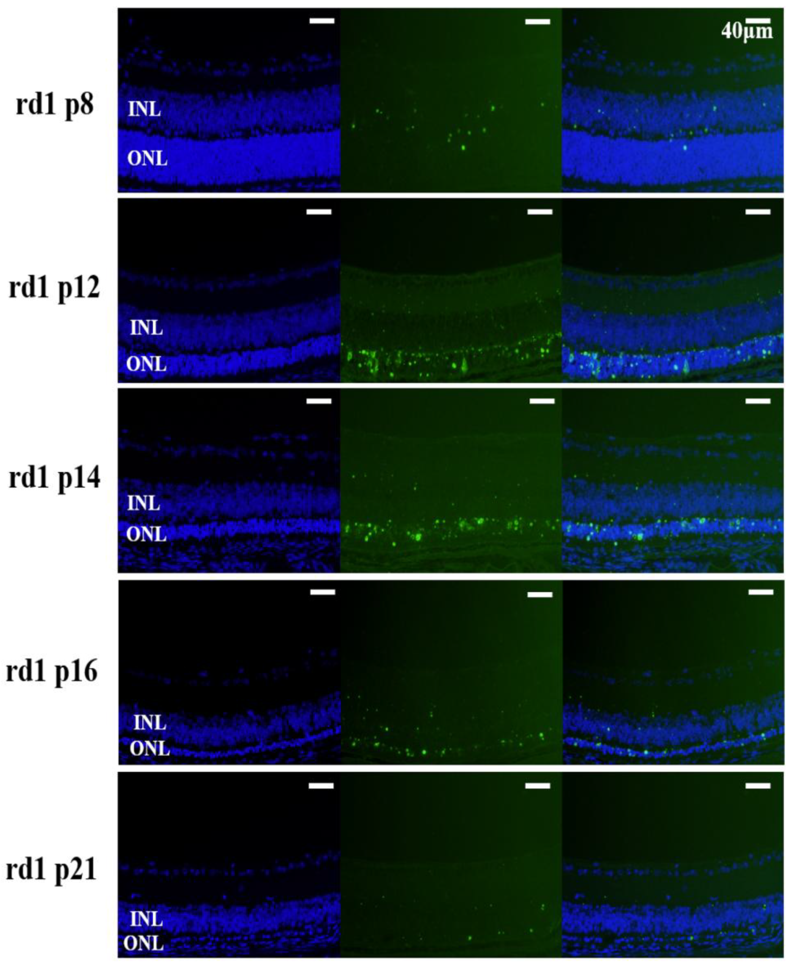 RNA Sequencing and Targeted Knockdown Reveal miR-142a-5p as a Driver of ...