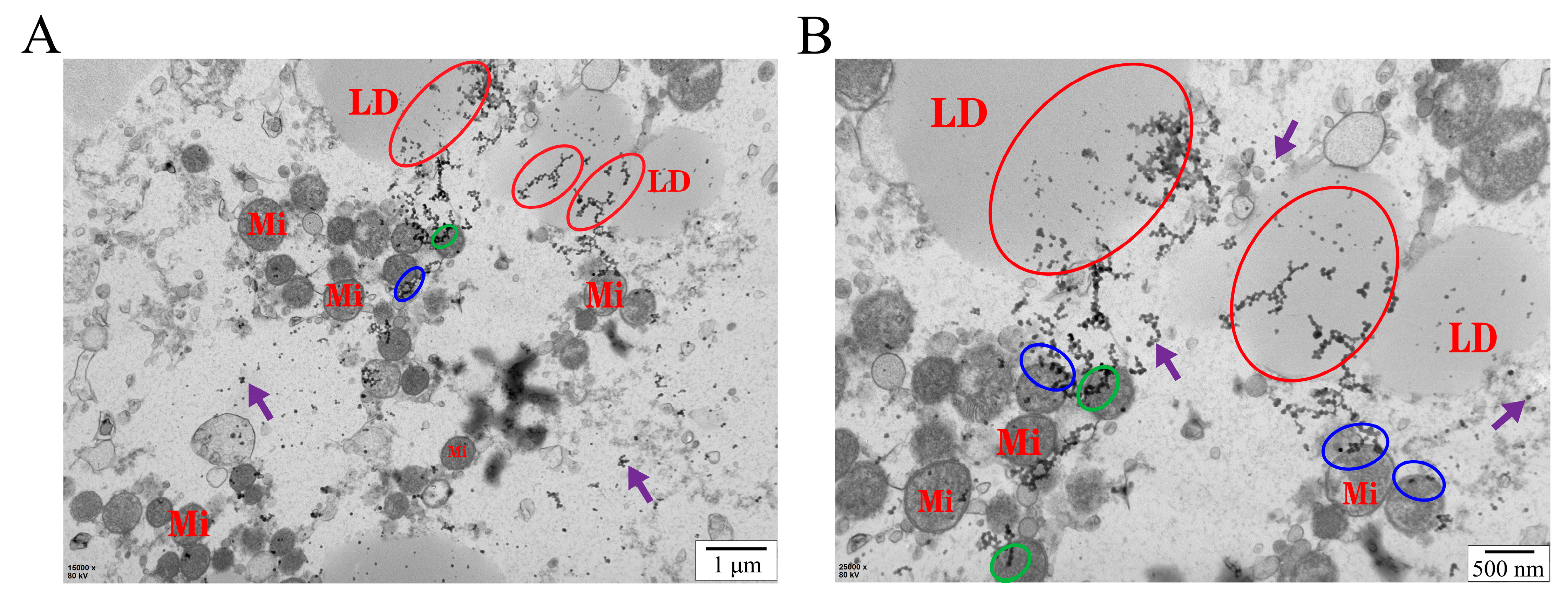 Effect of Hydroxyapatite Nanoparticles on the Ultrastructure ...