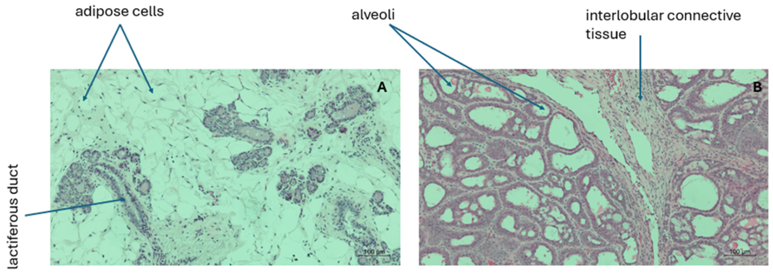 Maternal Methyl Donor Nutrients Modulate Developmental Genes in Mammary ...