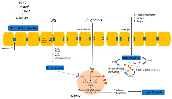 Involvement of Gut Microbiota in SLE and Lupus Nephritis