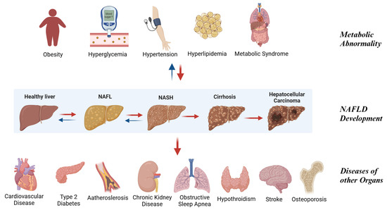 Therapeutic Targets and Approaches to Manage Inflammation of NAFLD
