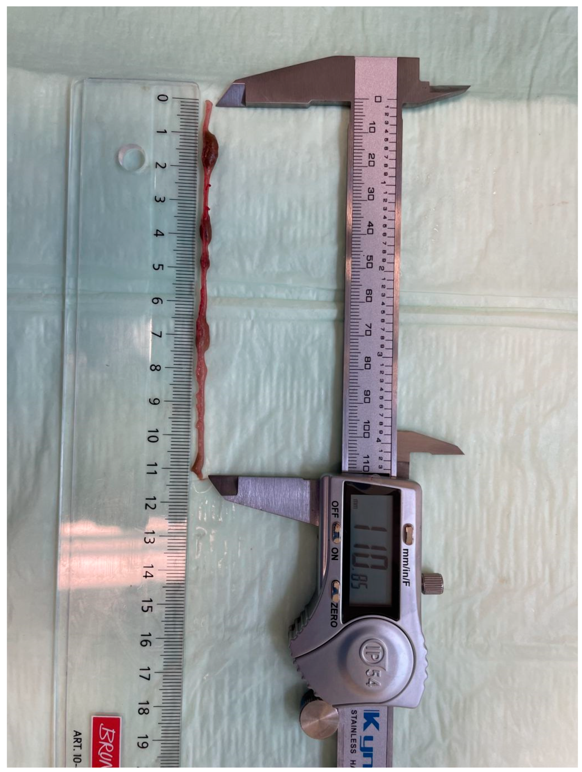 Shortcoming of the Mouse Model of Postoperative Ileus: Small Intestinal ...